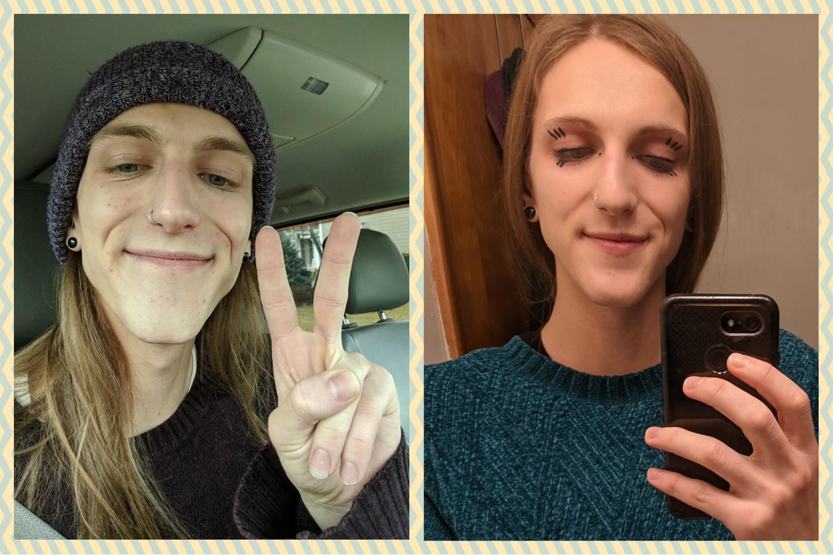 Facial changes after almost 5 months E monotherapy (injections), started at 21 and now 22 ...