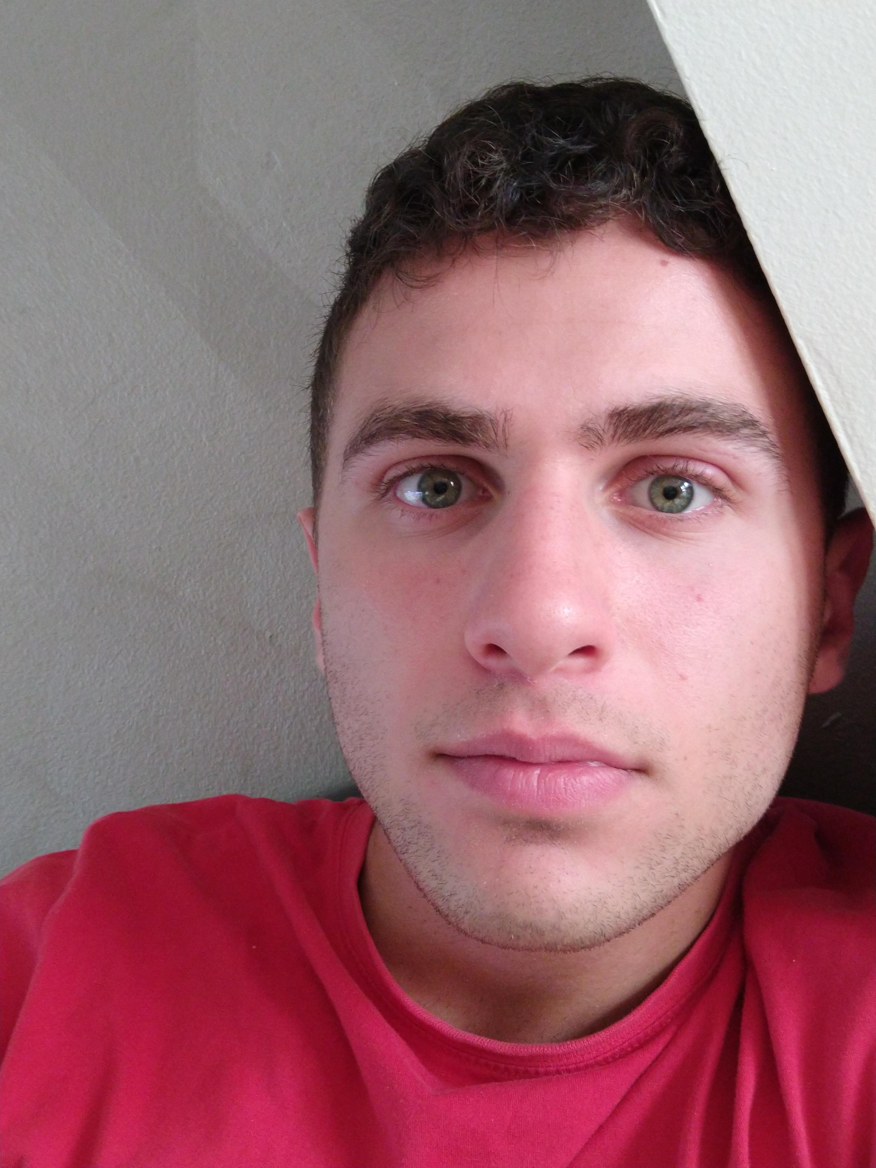 Featuring Sunburn 😎 | Scrolller