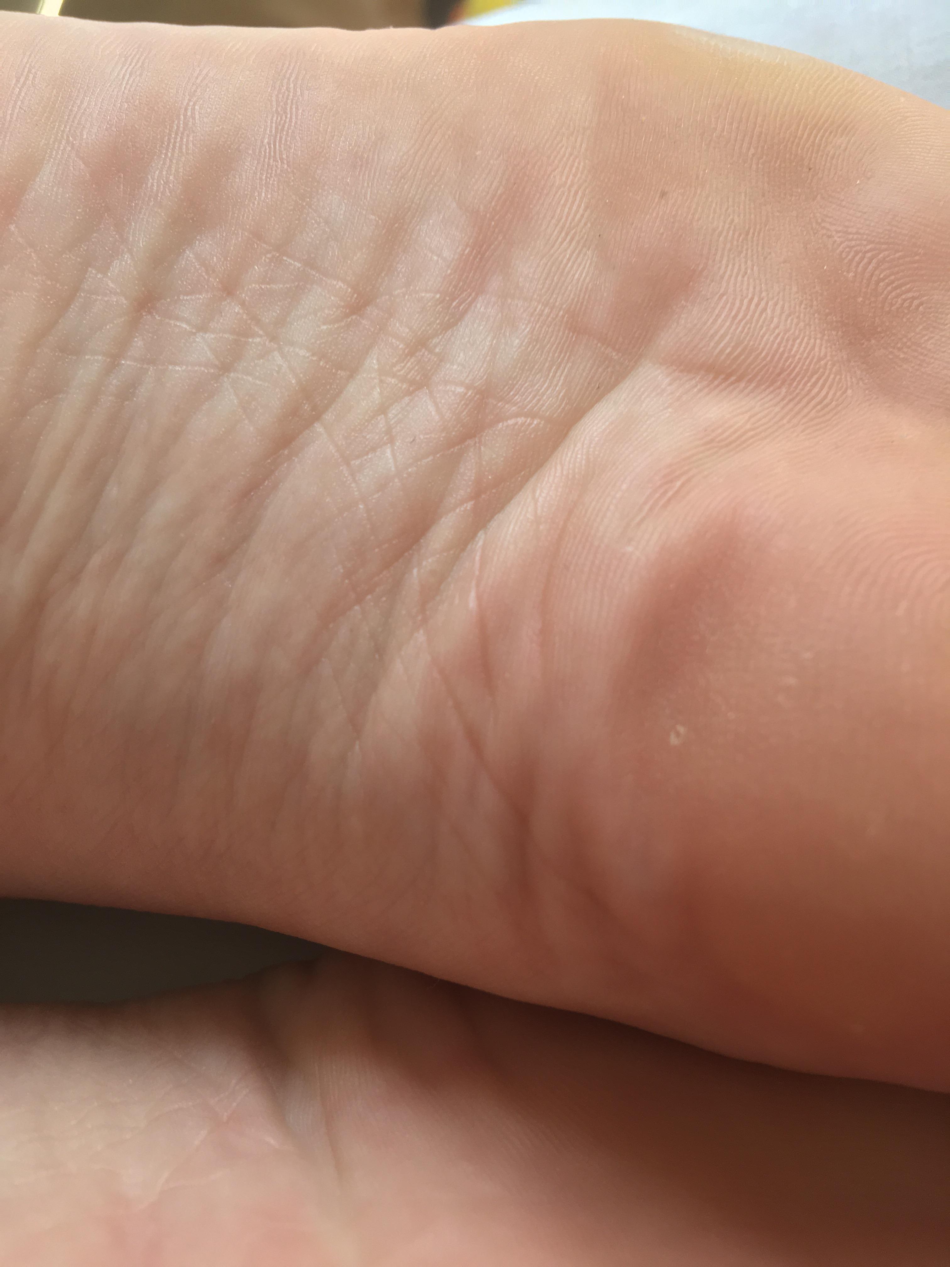 Feet close ups | Scrolller