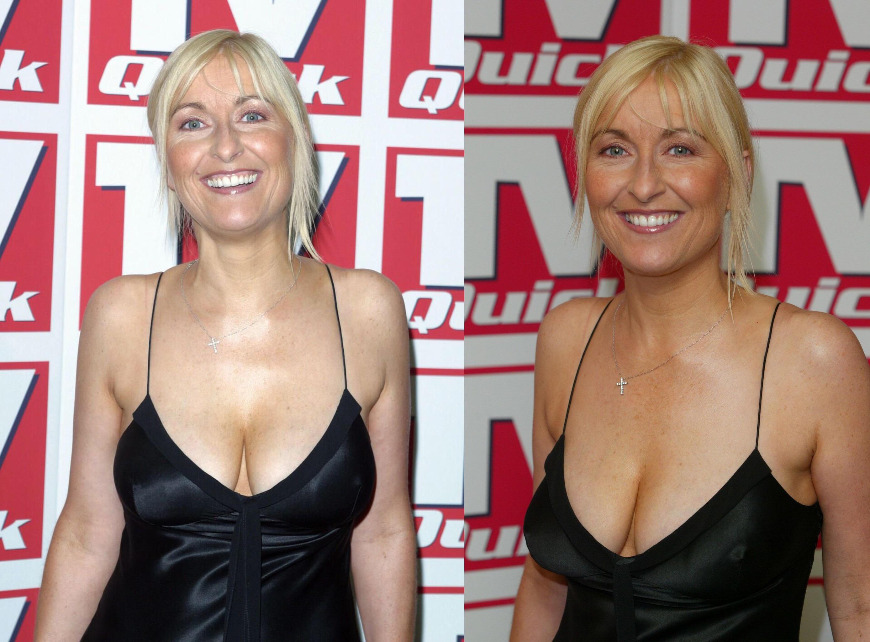 Fiona Phillips | Scrolller