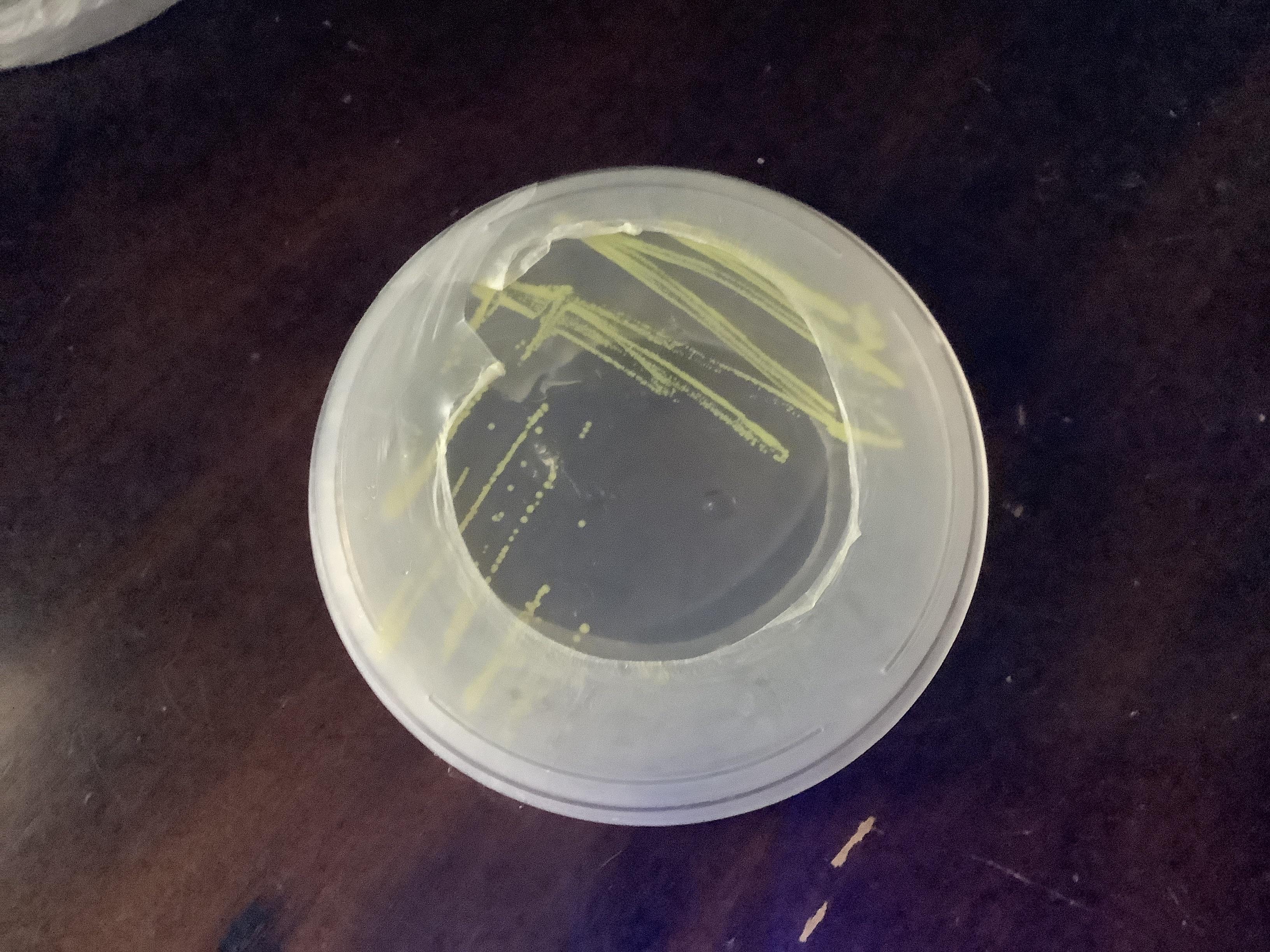 First time streaking bacteria, anything suggestions? | Scrolller