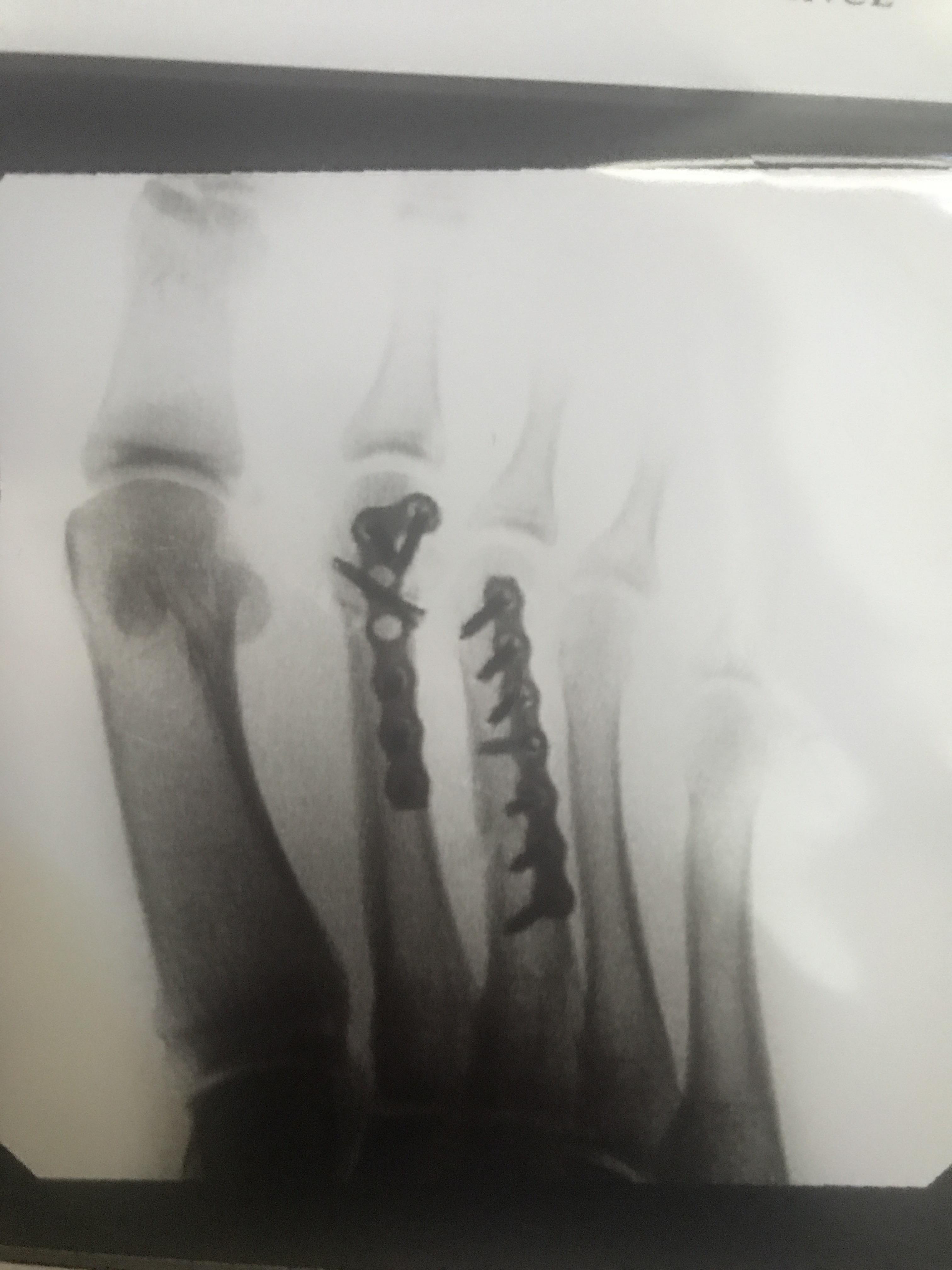 Foot got smushed, here’s the aftermath | Scrolller