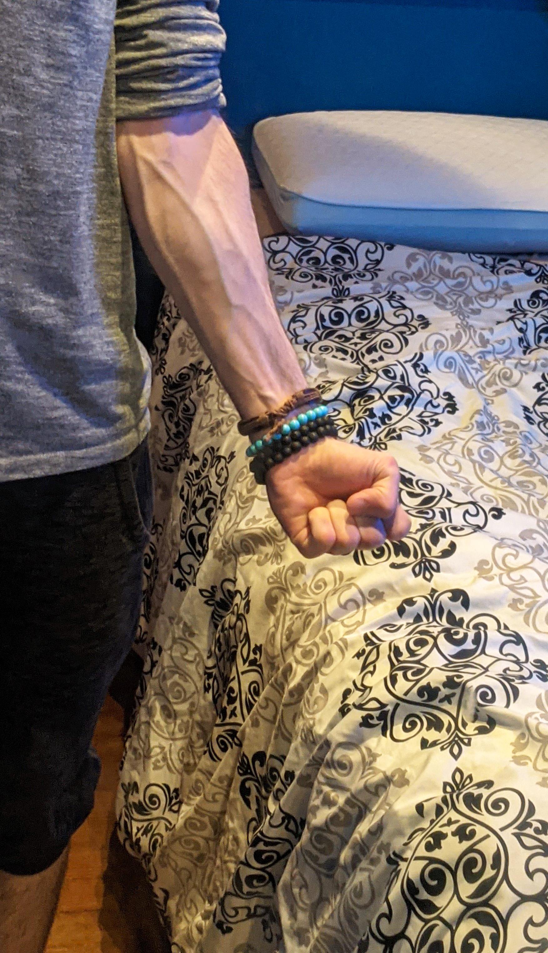 Forearm Veins Wont Be An Issue Will They Scrolller
