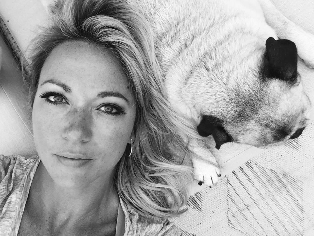 Freckle face Brooke Baldwin | Scrolller