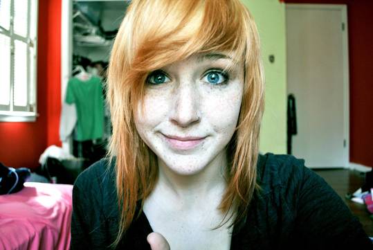 Freckles | Scrolller