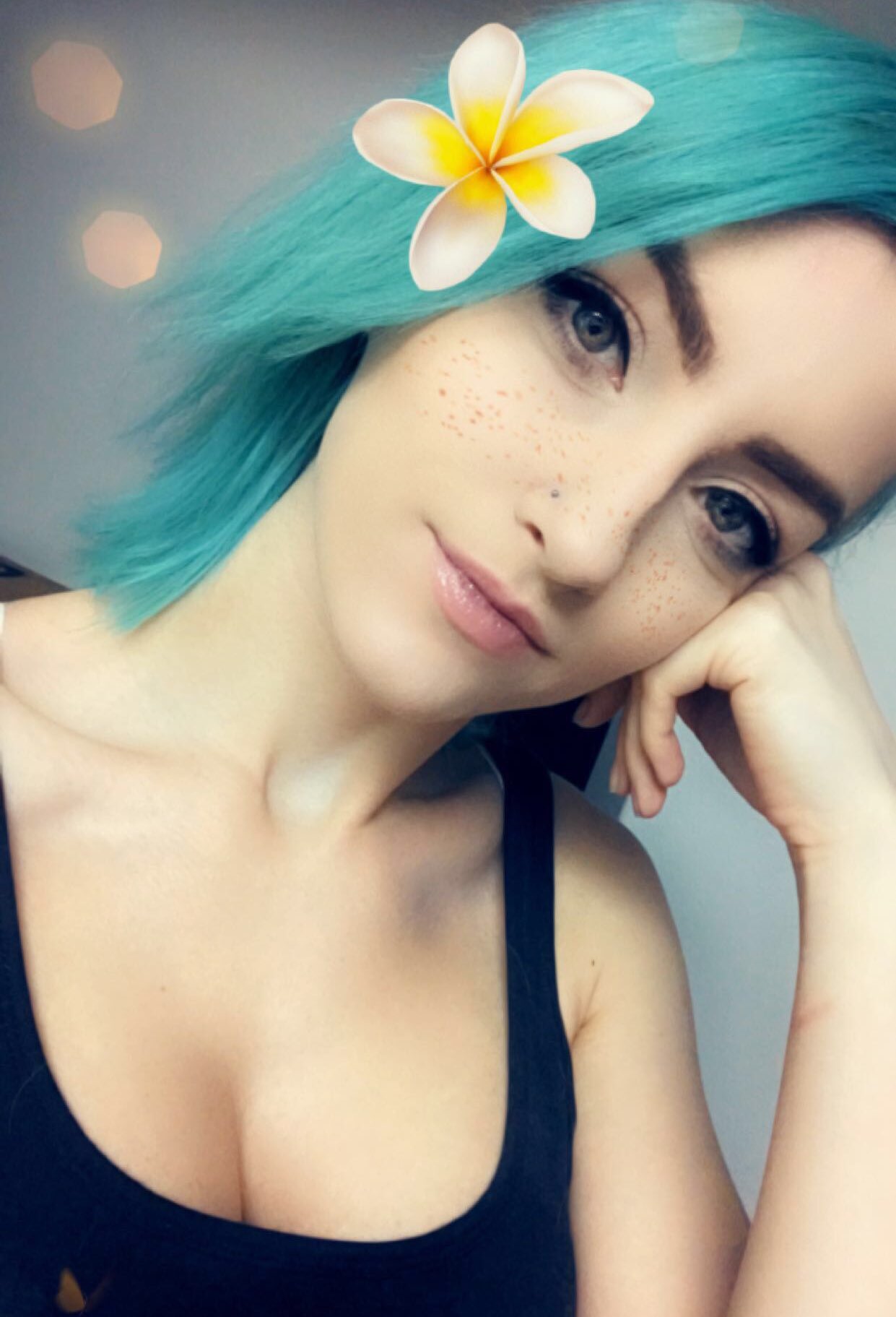 Freckles | Scrolller