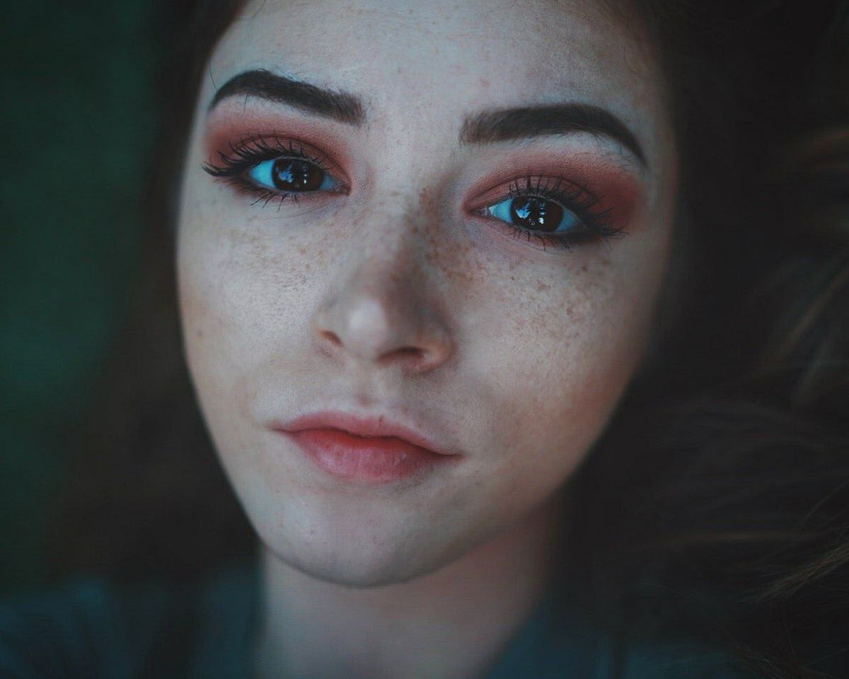 Freckles all over | Scrolller