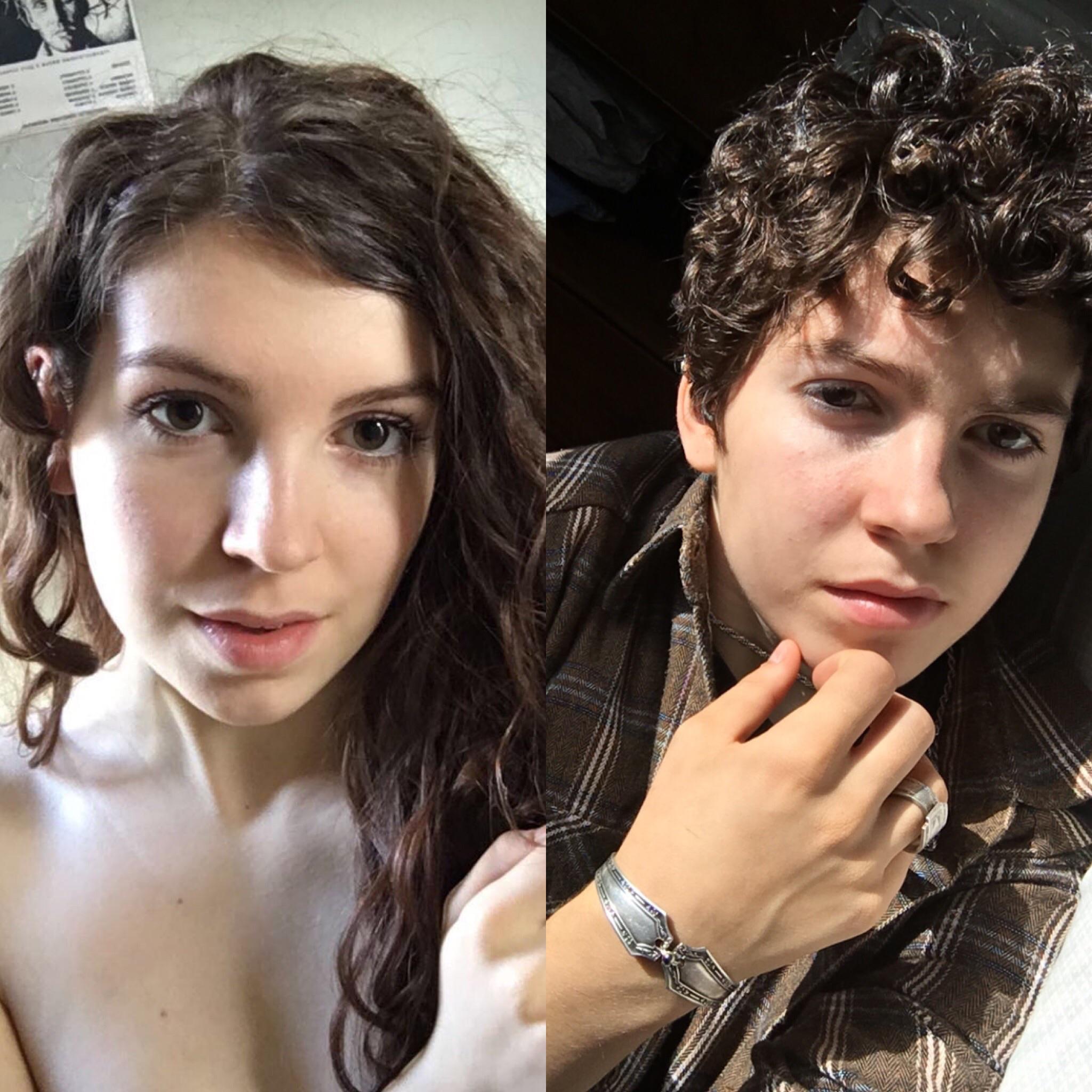 Ftm Pre-T (6 months between pics) | Scrolller