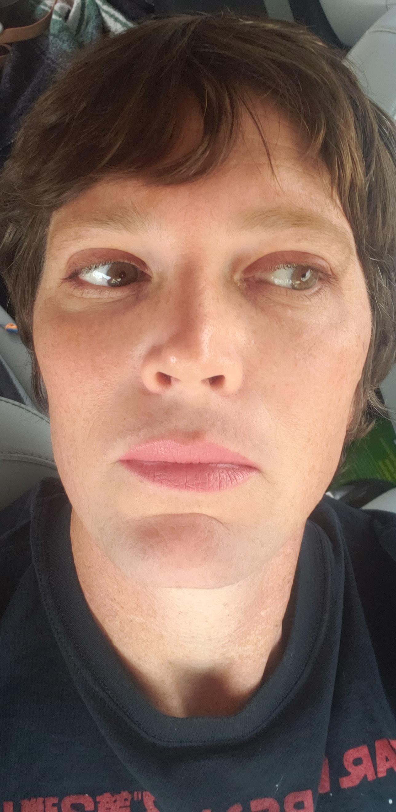 Going to have my first blood draw today! | Scrolller