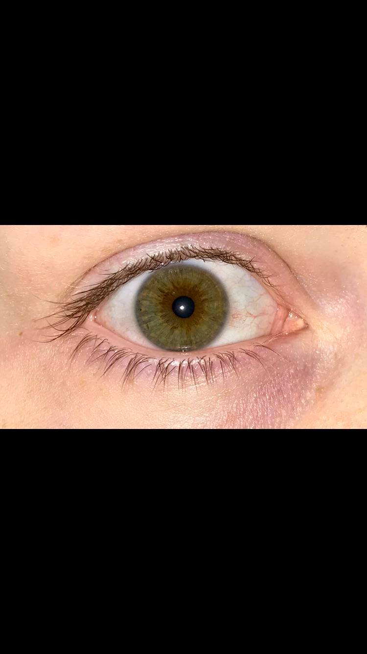 Green? Hazel? Heterochromia? | Scrolller