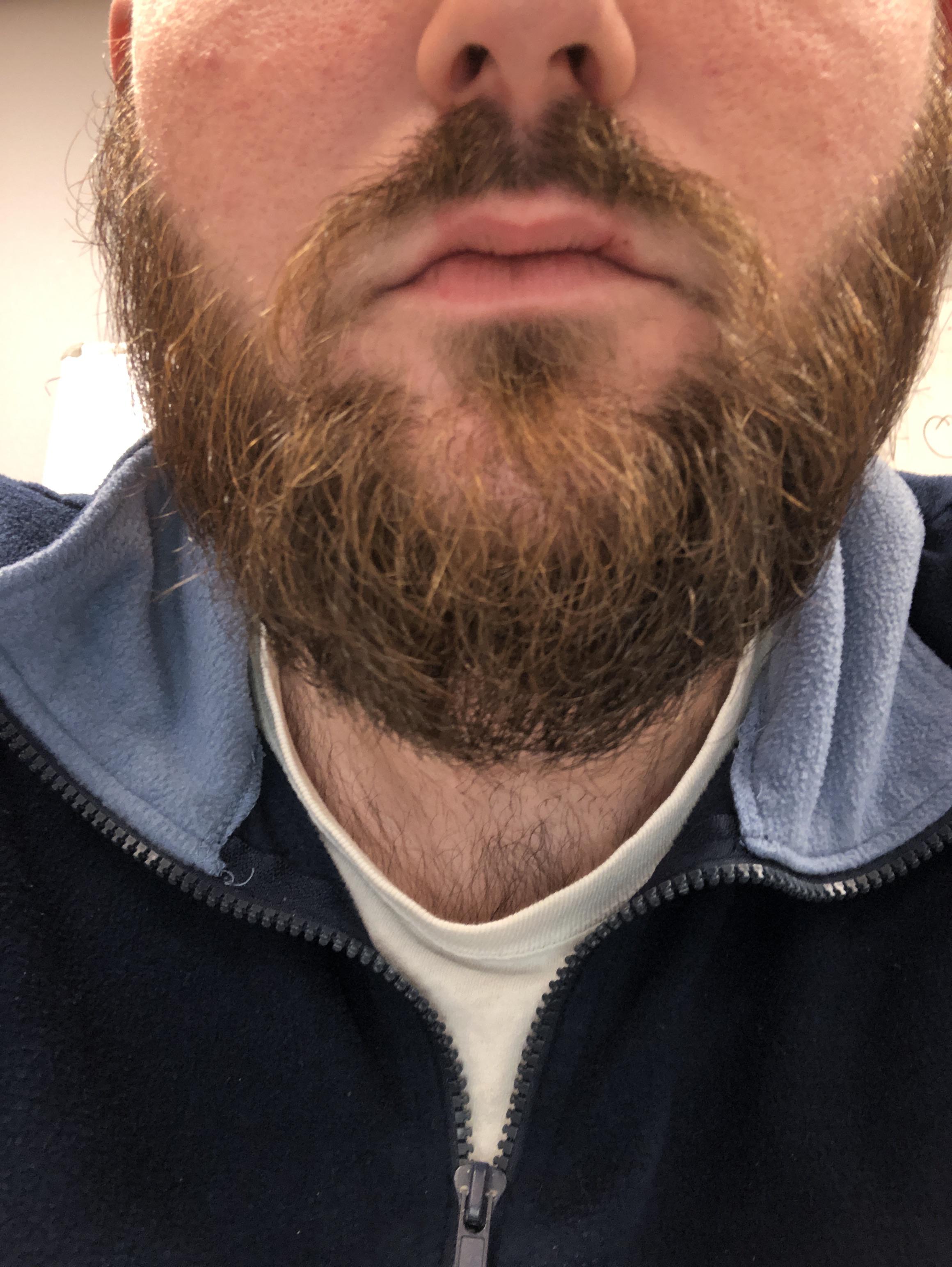 Growing it back out. | Scrolller