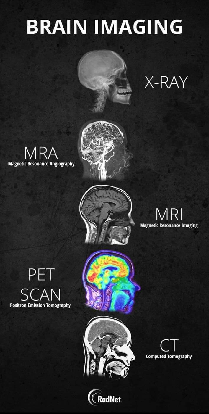 Guide to different types of brain imaging | Scrolller