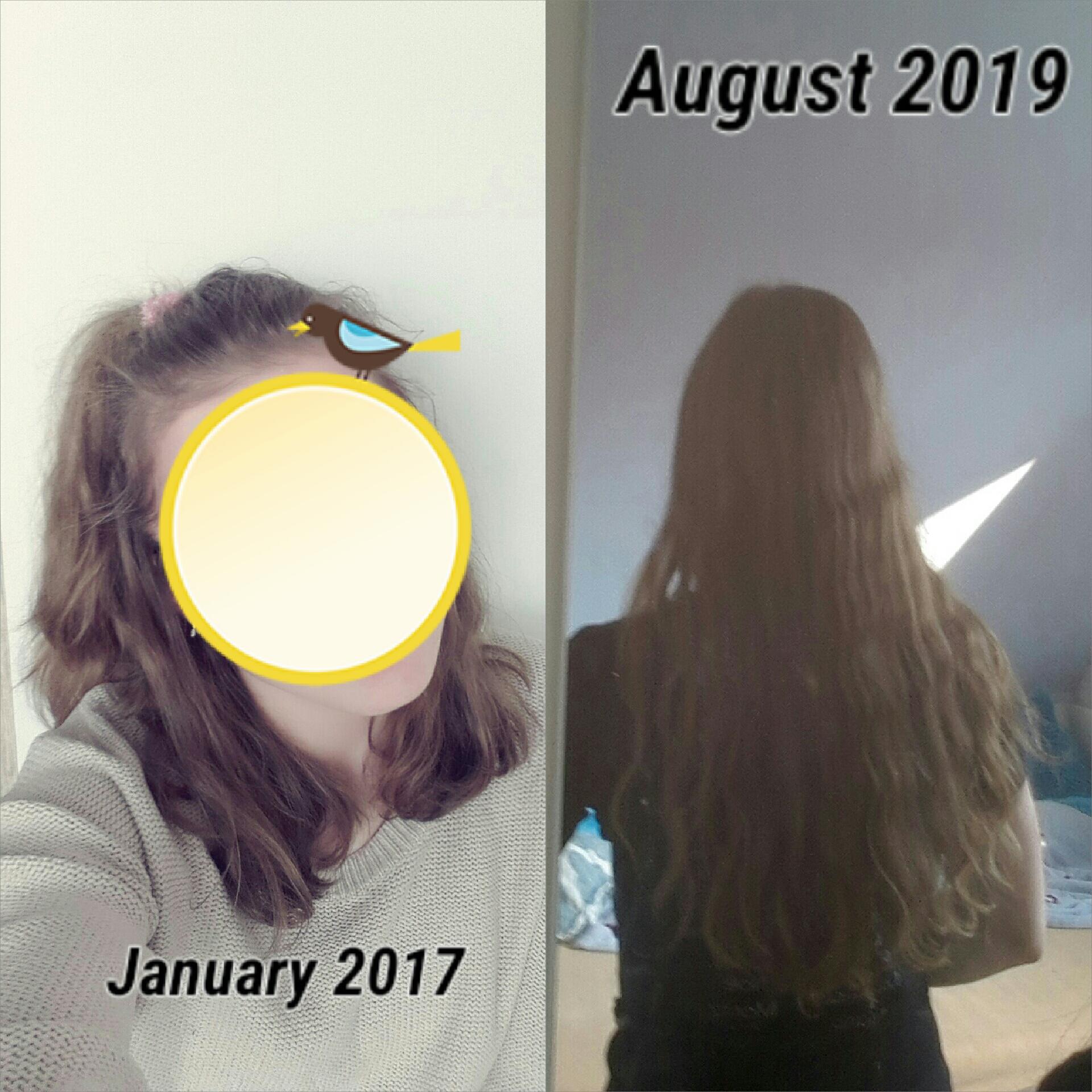 Hair growth so far | Scrolller