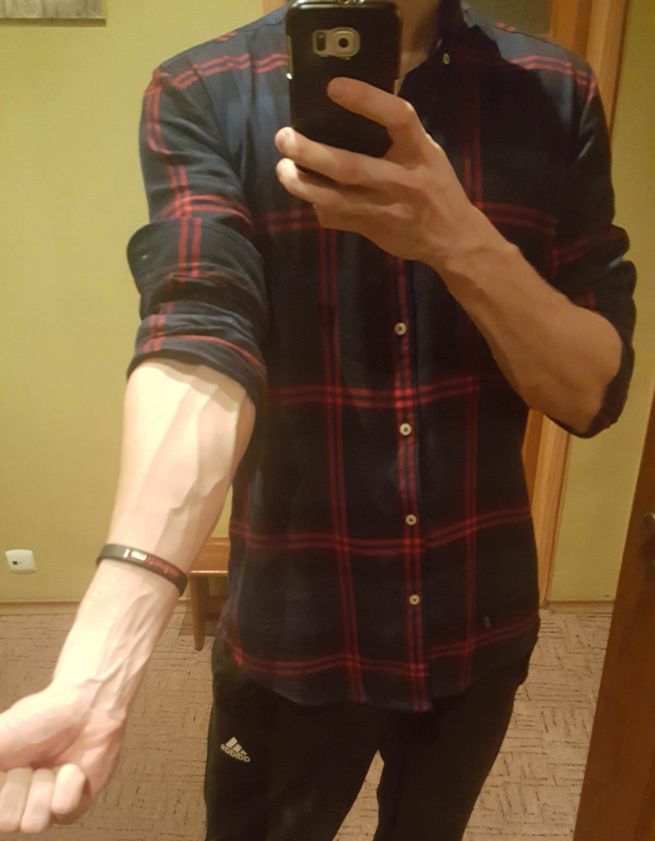 hangover veins | Scrolller