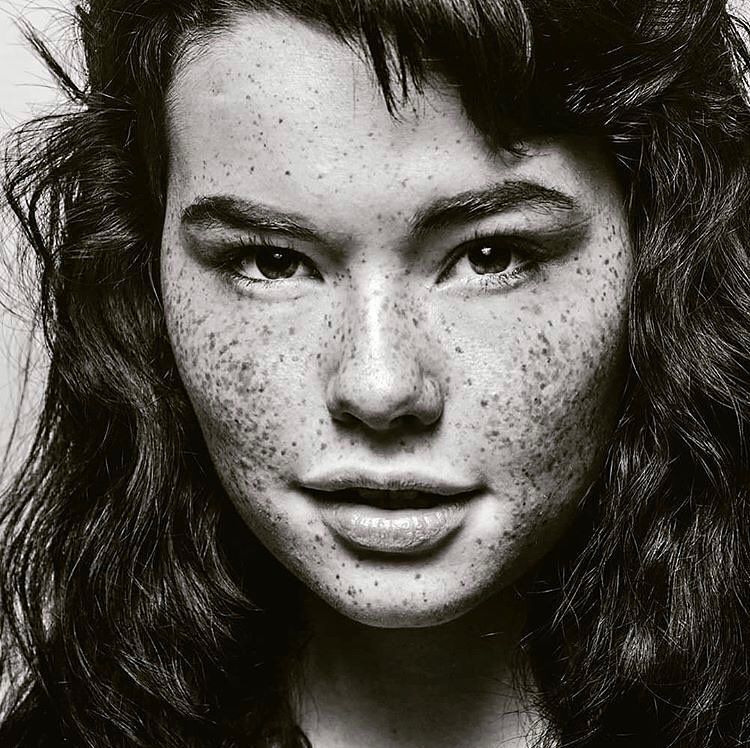 HD freckles. | Scrolller