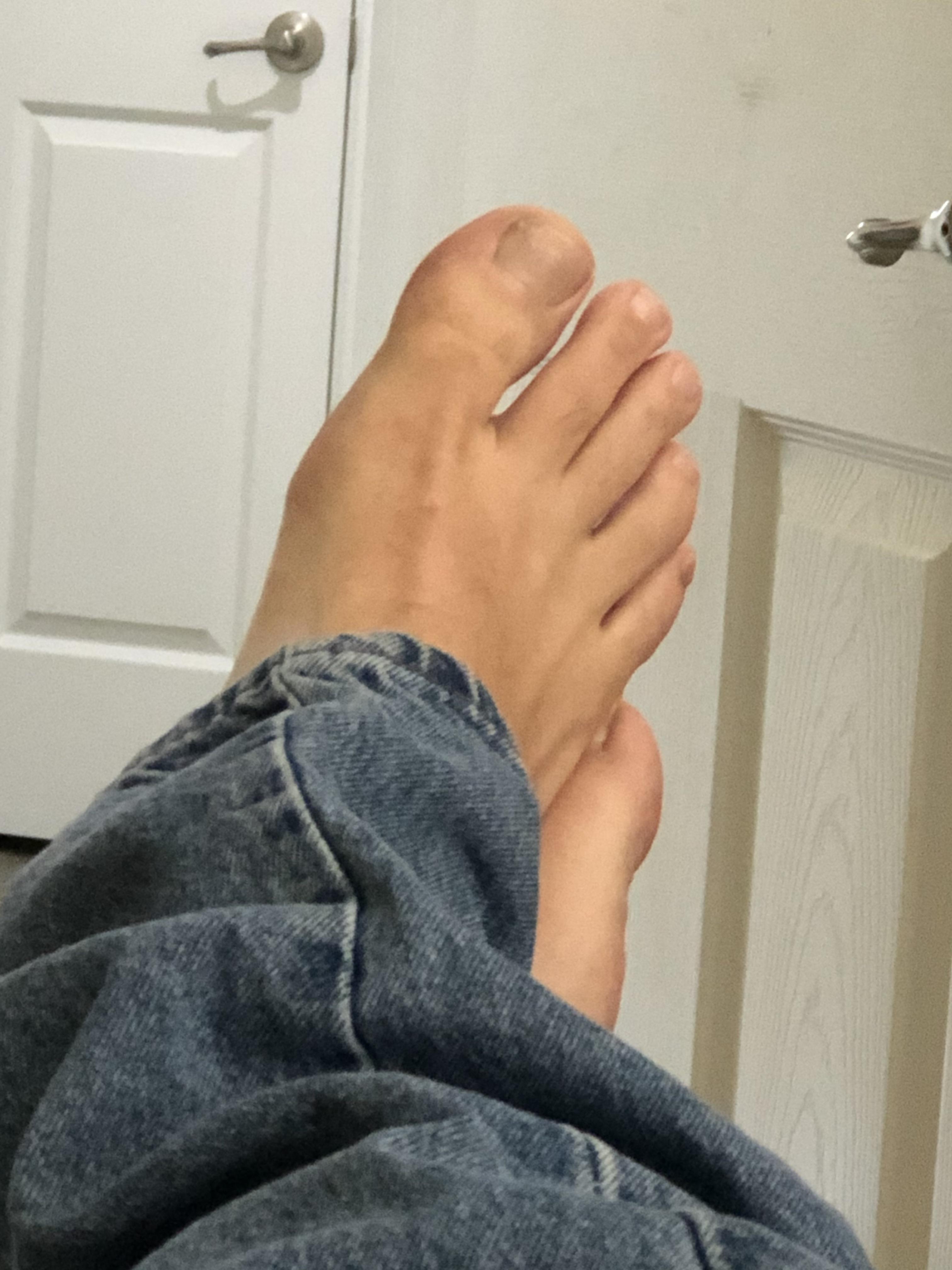 Hello toes | Scrolller