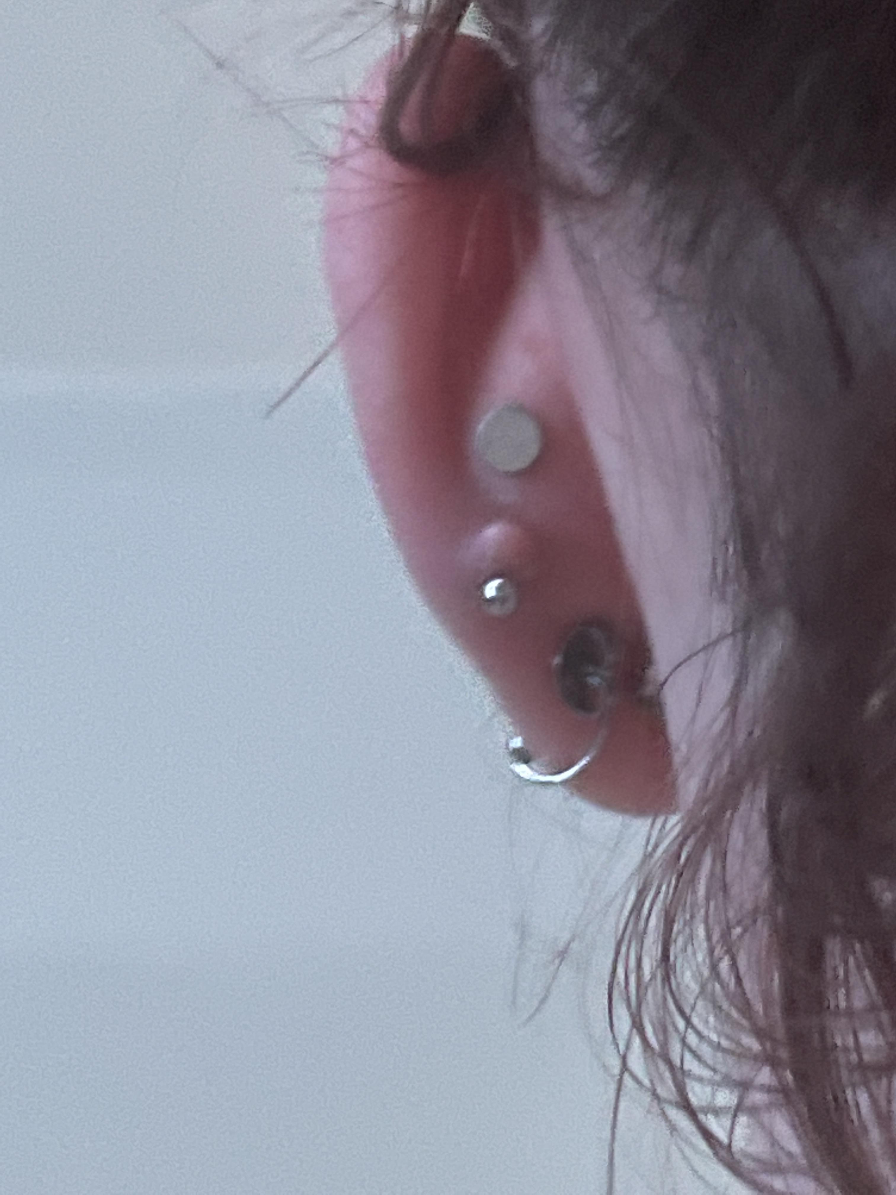 Help ~ Bump after one month since pericing any idea what this could be? | Scrolller