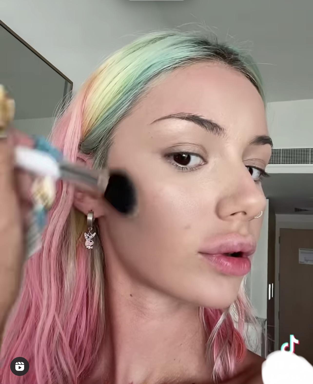 Her upper lip is 50% filler migration | Scrolller