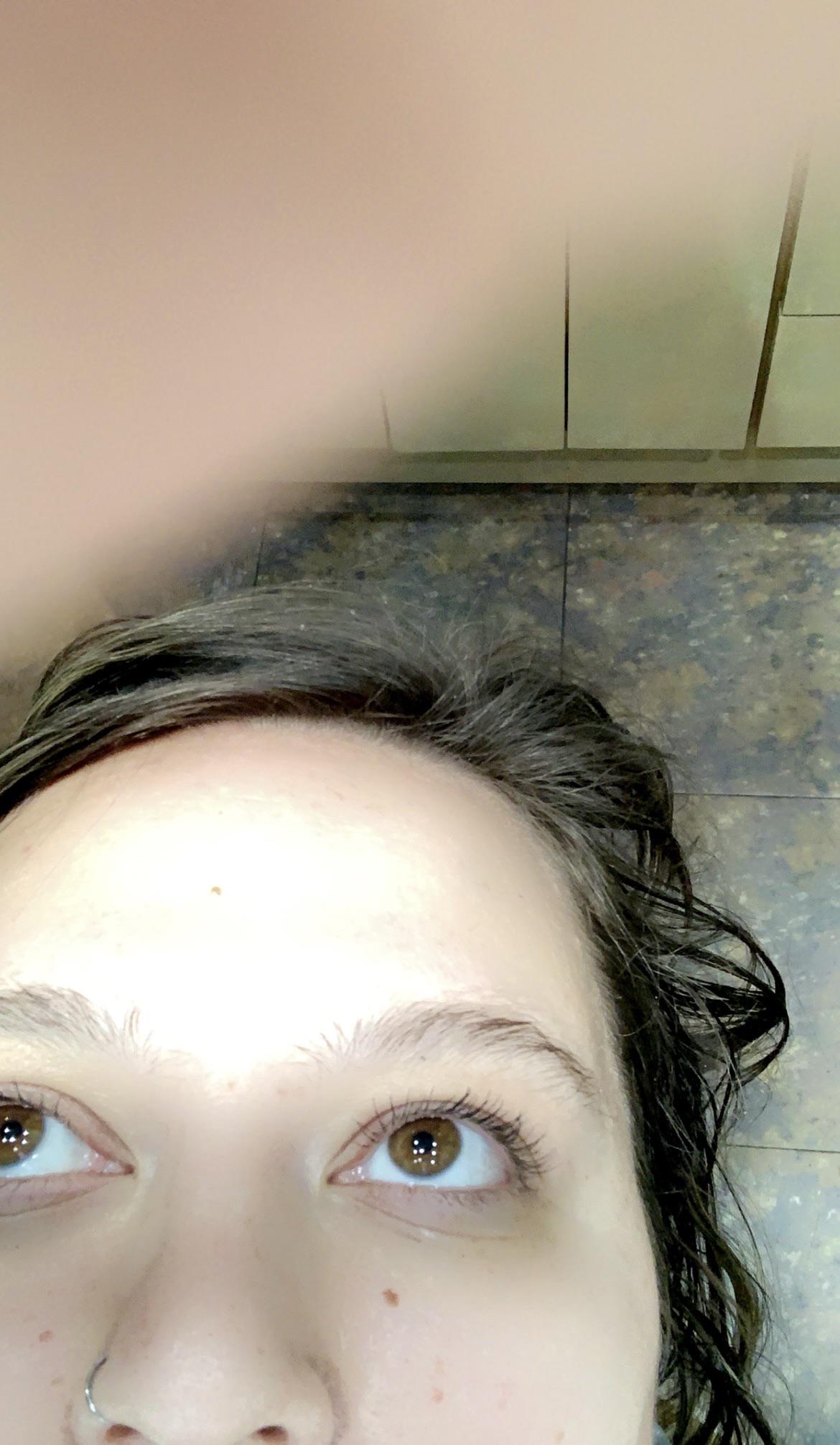 Here’s the most random dentist weird selfie lol while I sit here numb (over18) | Scrolller