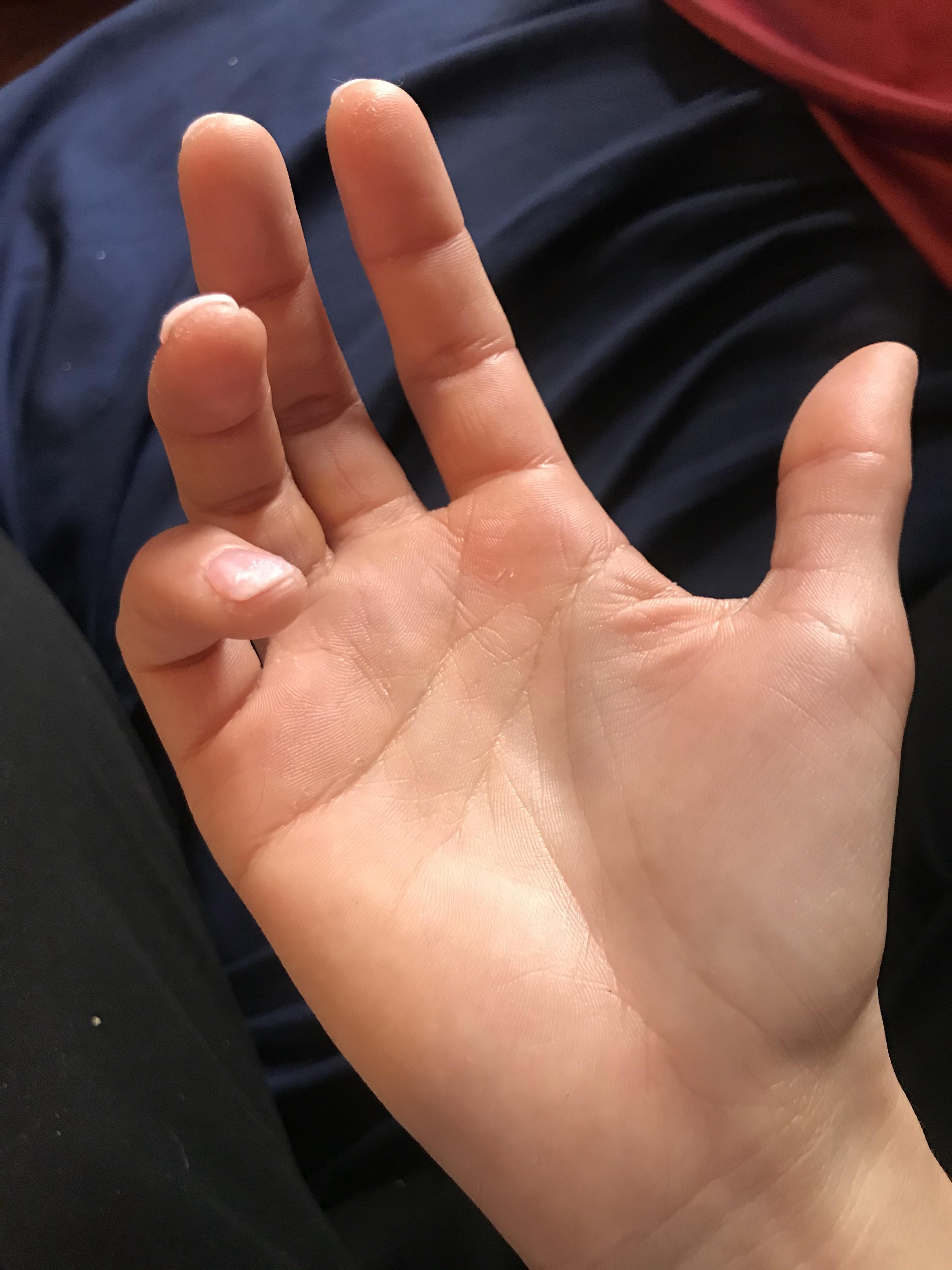 Here you go, palm up (: | Scrolller