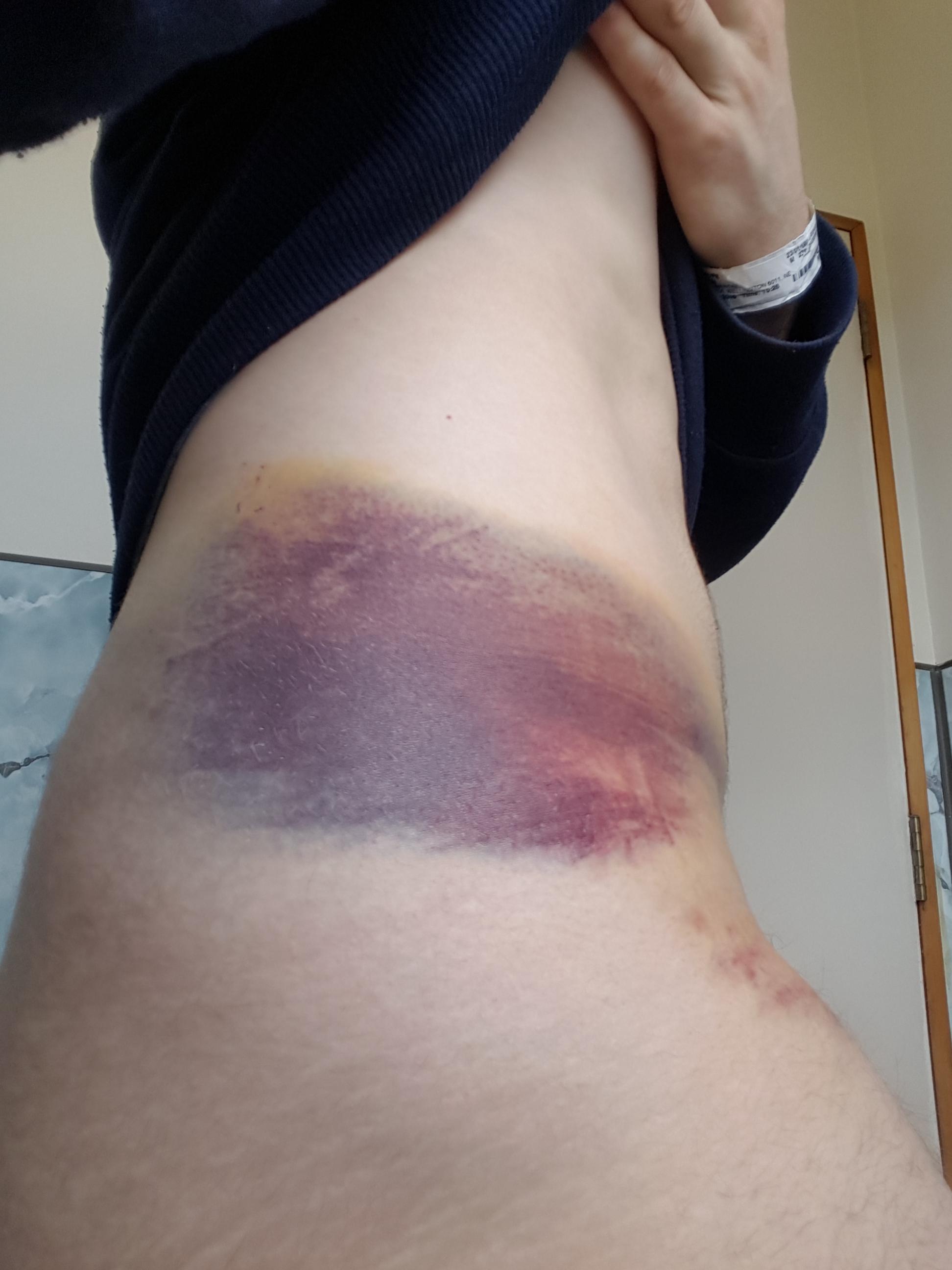 High Speed Longboarding Crash | Scrolller