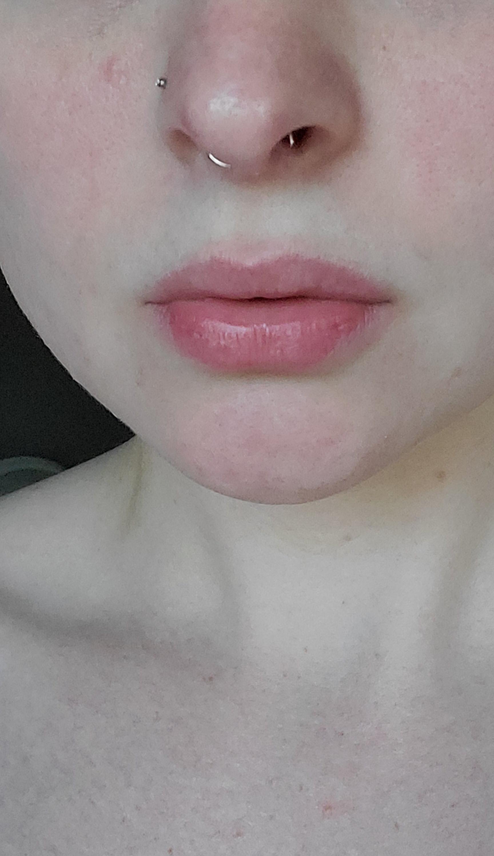 Hinge piercing stuck in nose. Won't move in either direction. Please help | Scrolller