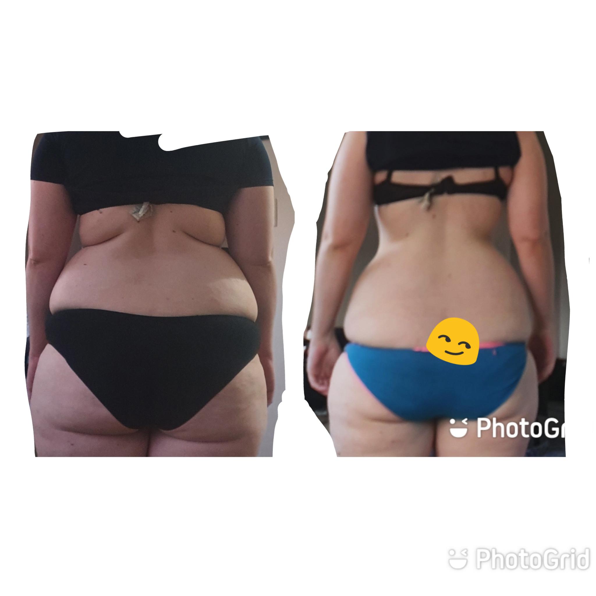 Holy Back Boobs! This is only two days shy of 1.5 months on IF and low carb. | Scrolller