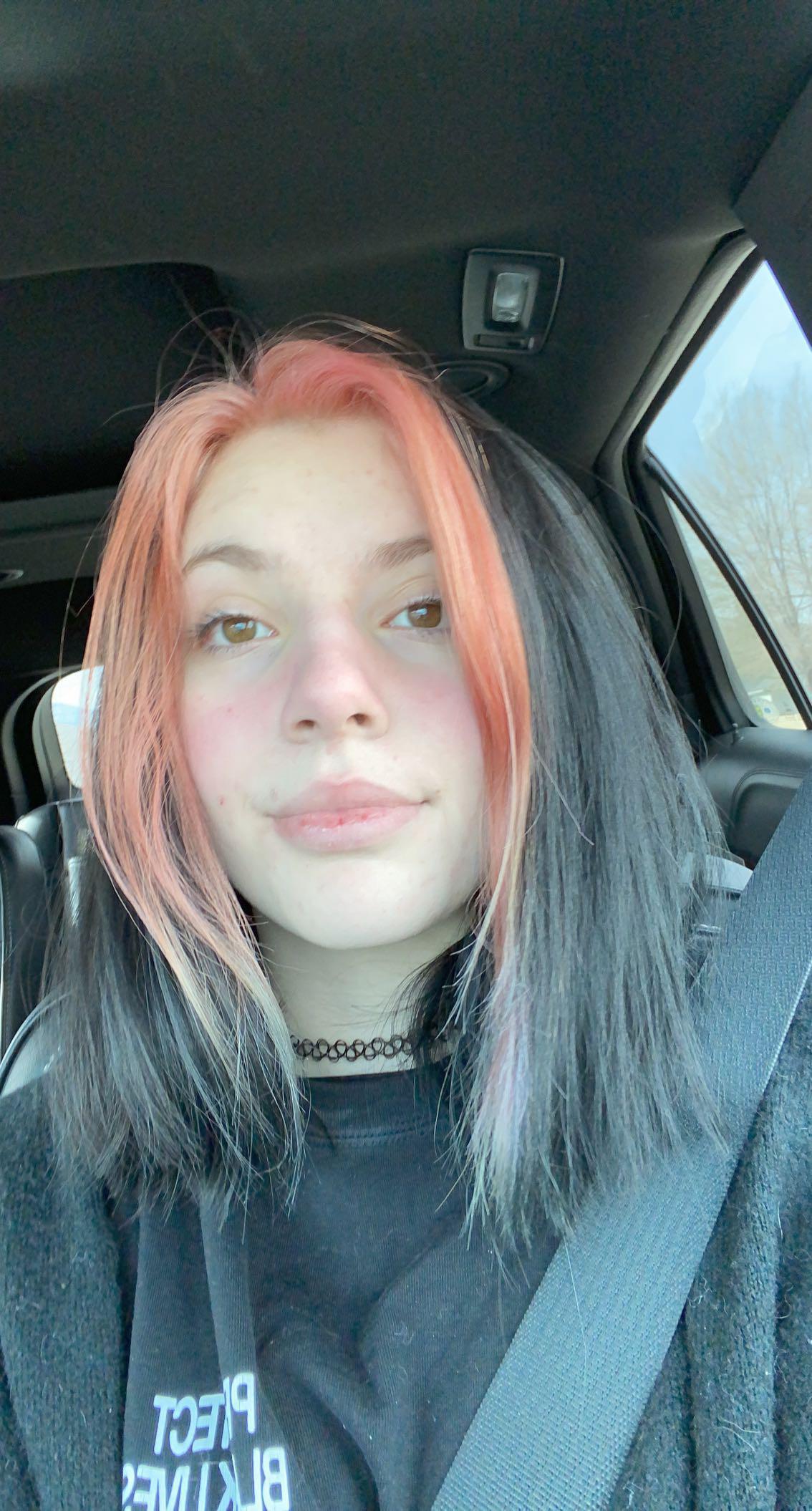 i bite my lips too much | Scrolller