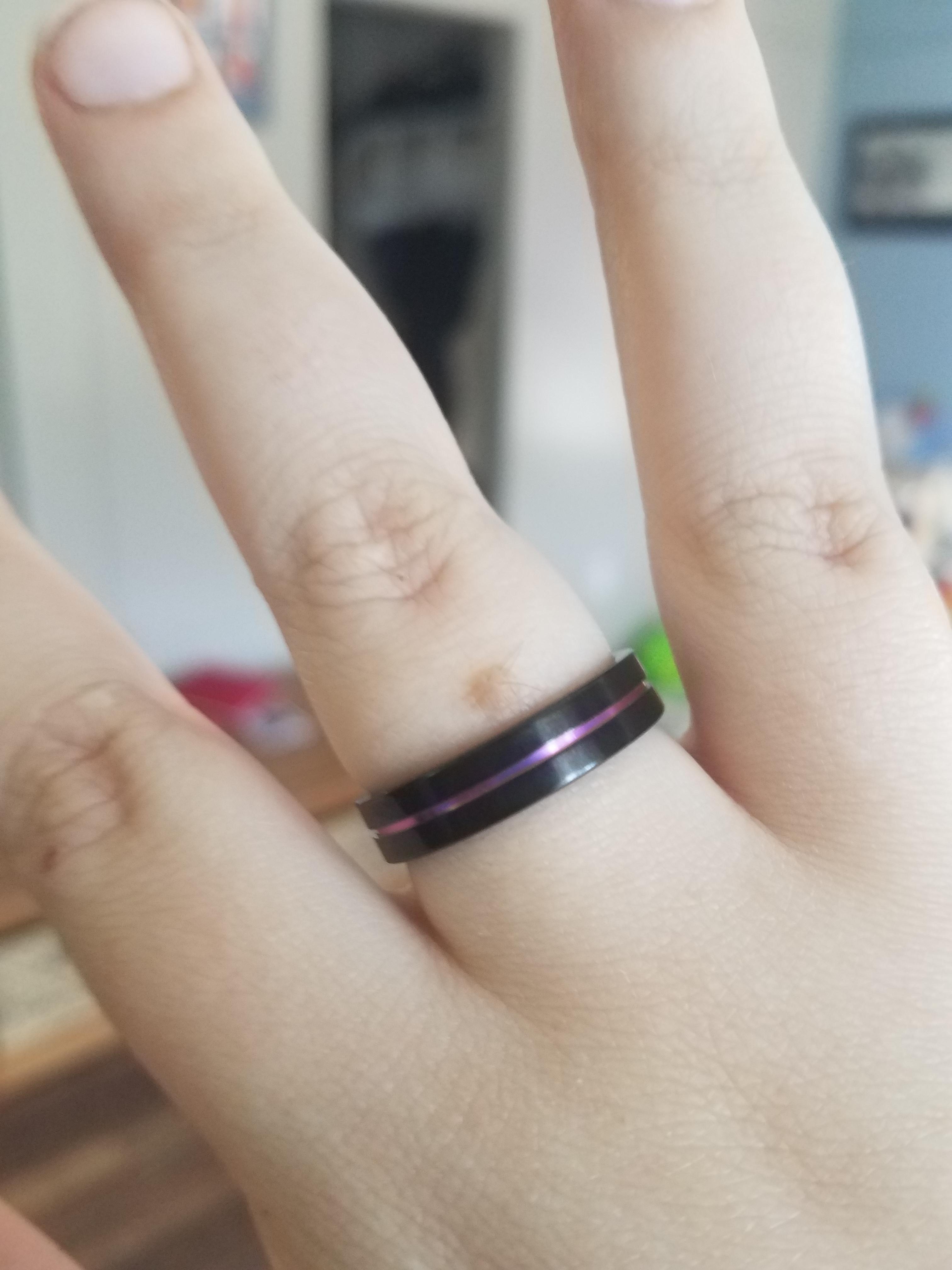 I got my ace ring!! | Scrolller