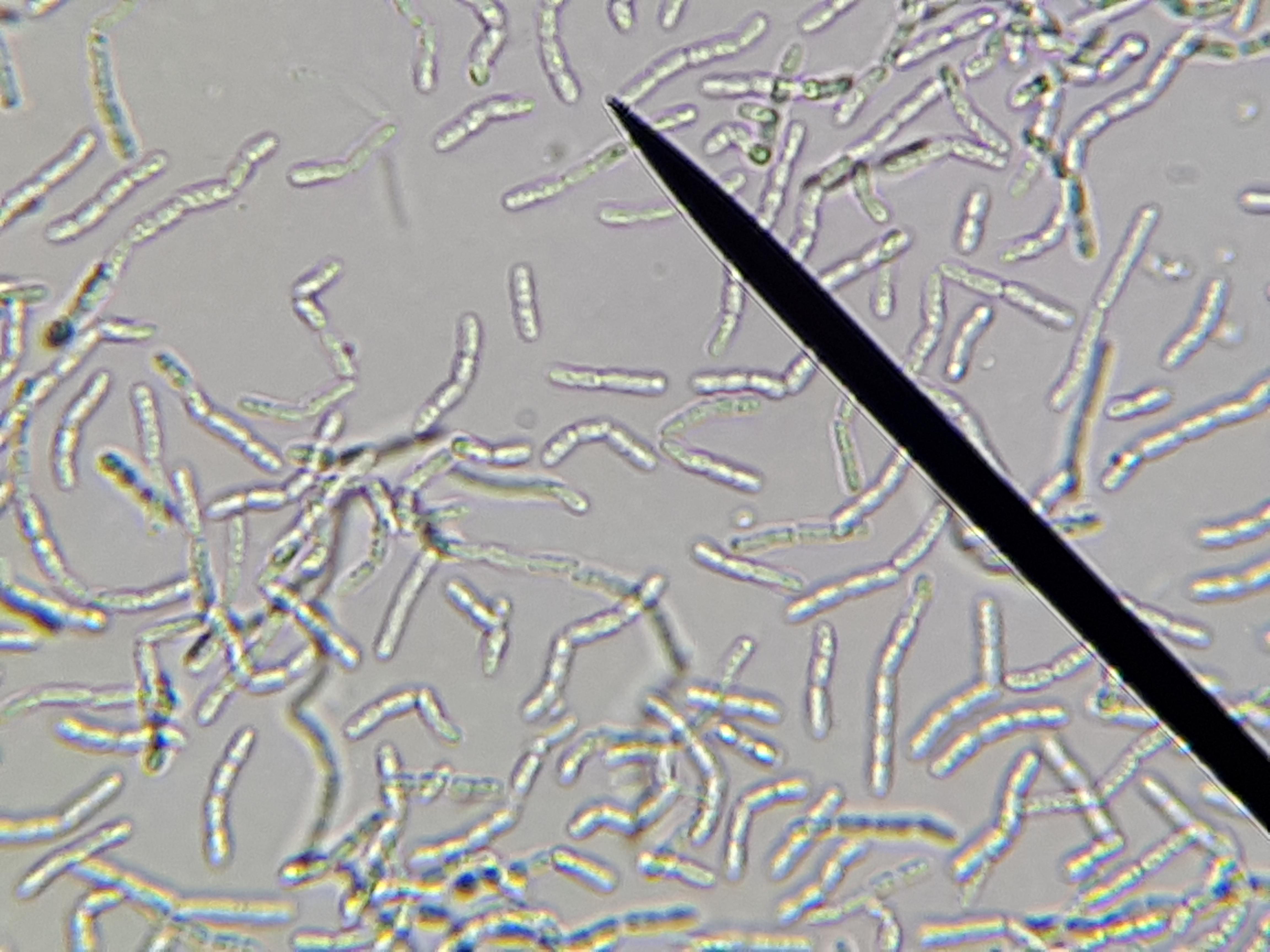 Incubated petri dish after swabbing armpit. 600x magnification of armpit bacteria. | Scrolller