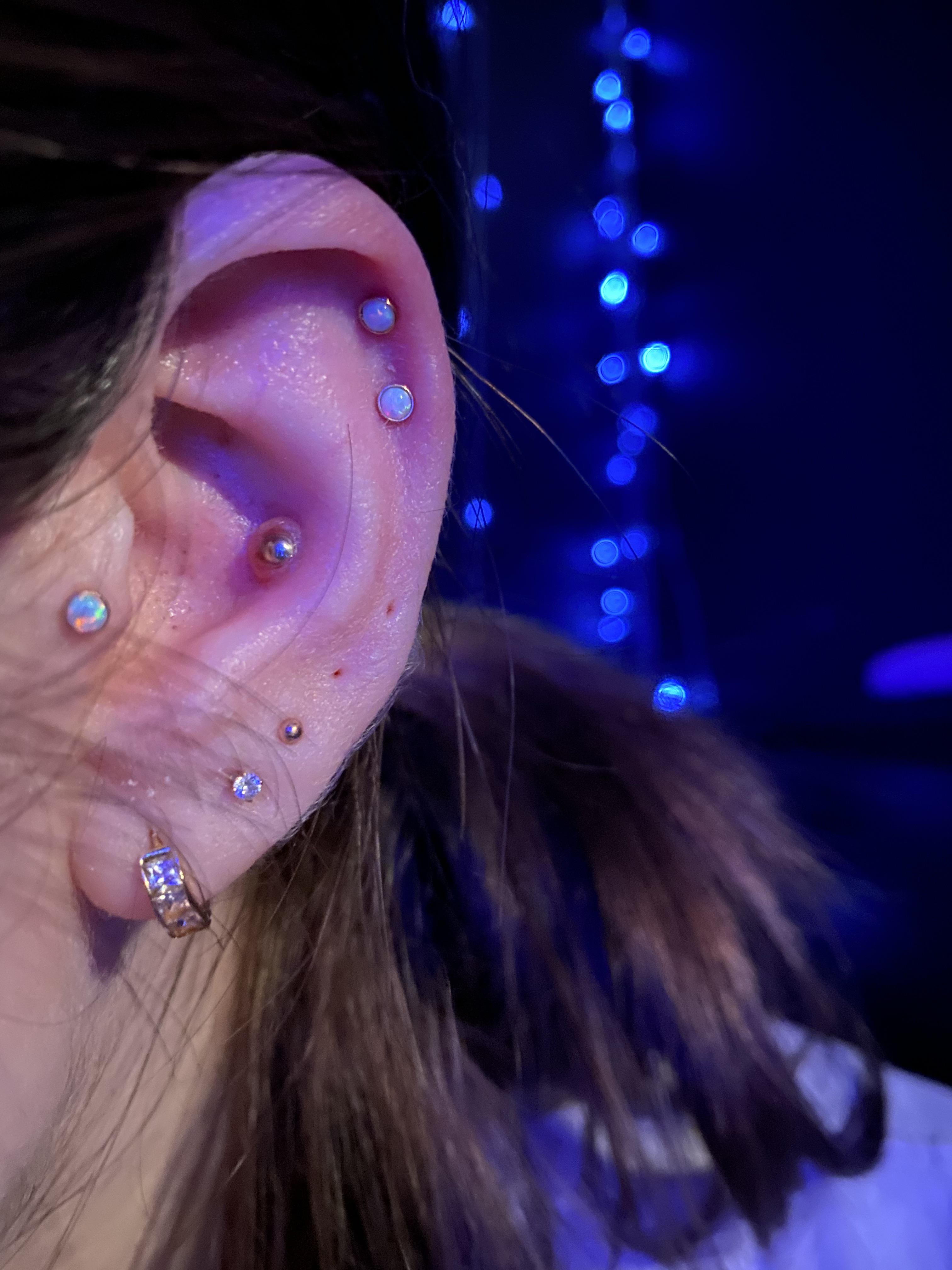 Irritation bump on conch. Any advice on how to get rid of it? I love this piercing but this bump ...