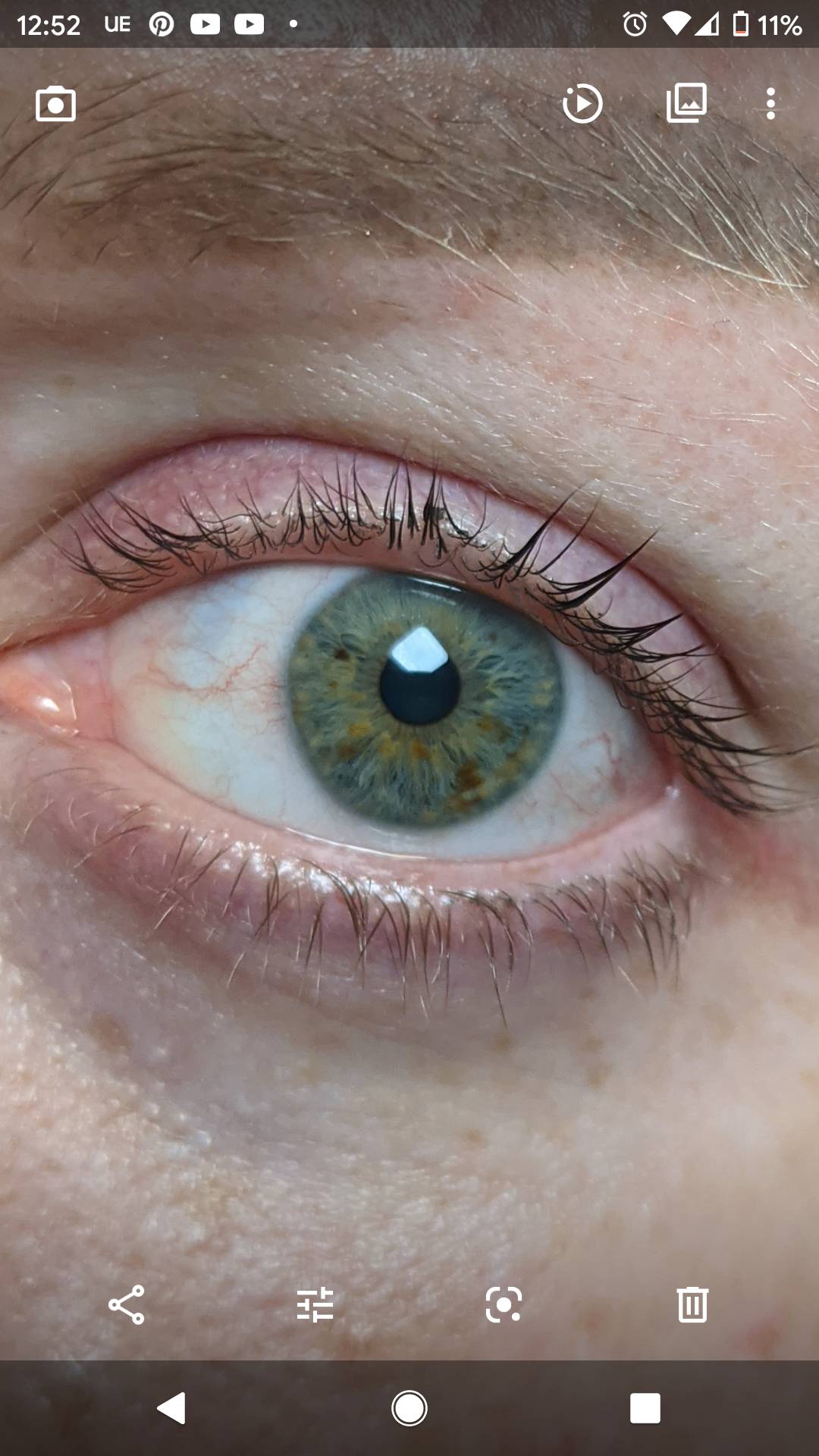 Is this heterochromia or something else? | Scrolller