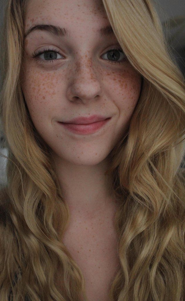 it's freckle season get them while they're hot | Scrolller