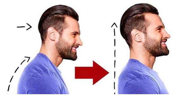 Just fix your posture, bro. | Scrolller