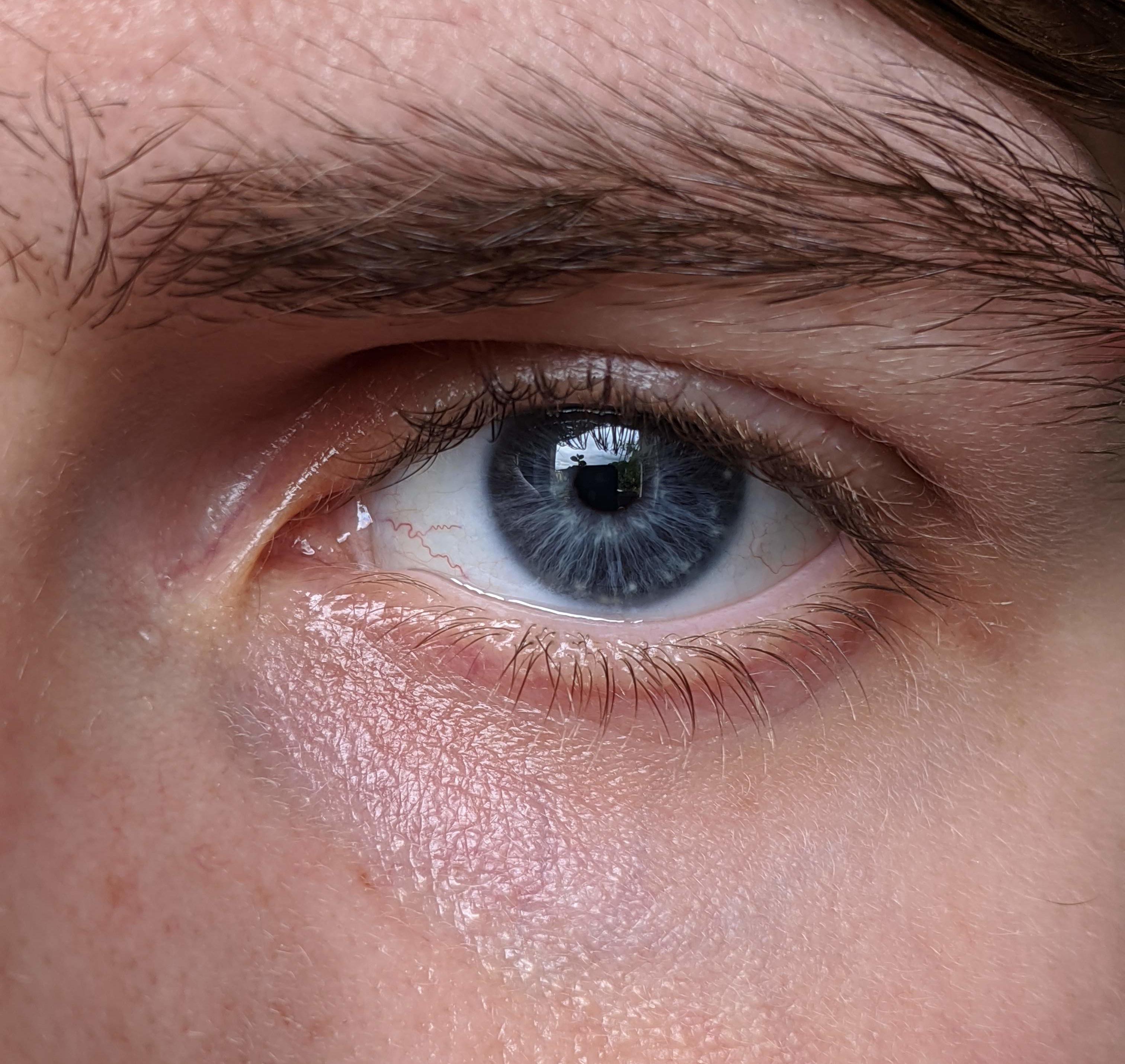 Left eye | Scrolller