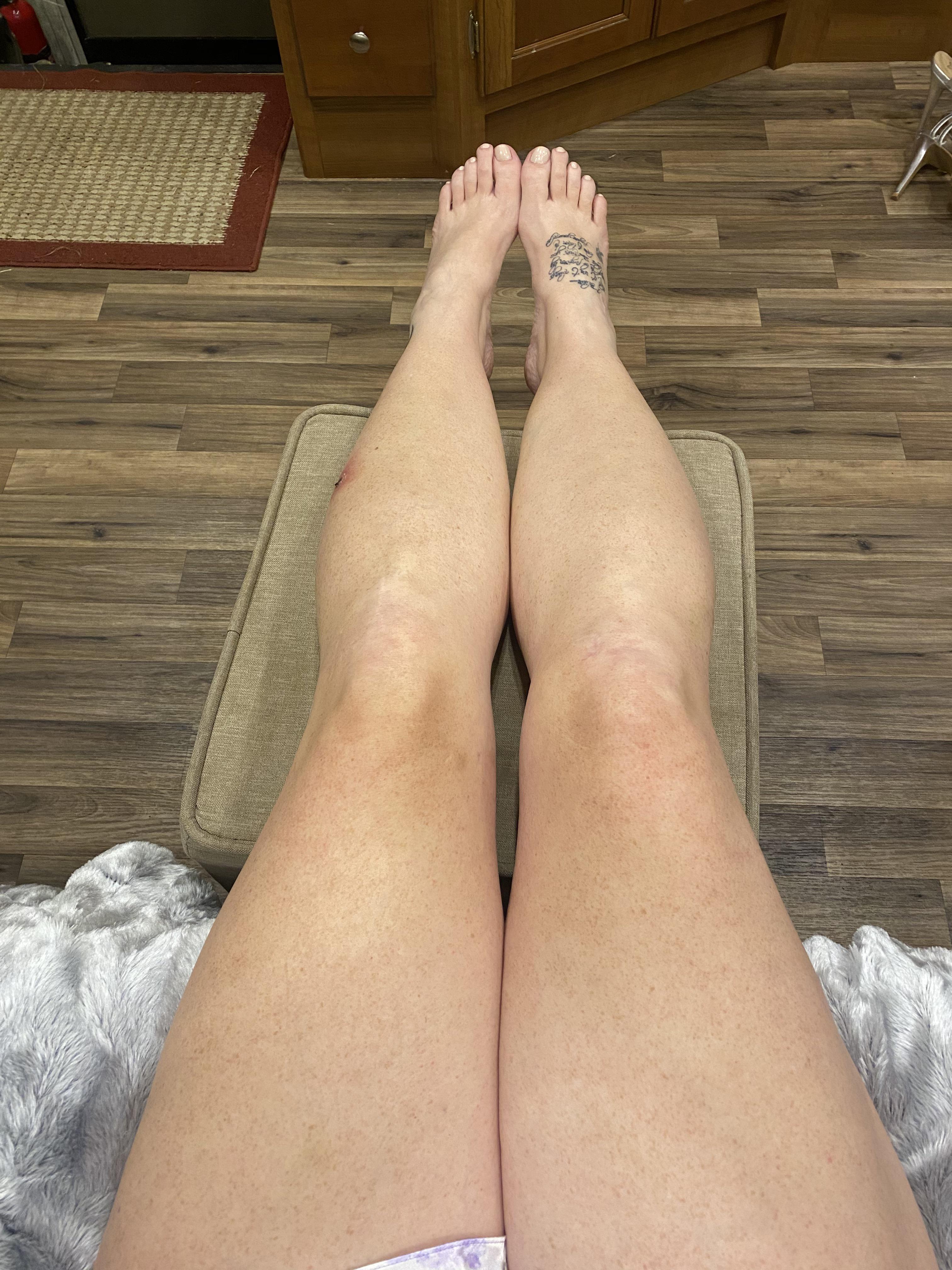 Legs and feet at rest finally. | Scrolller