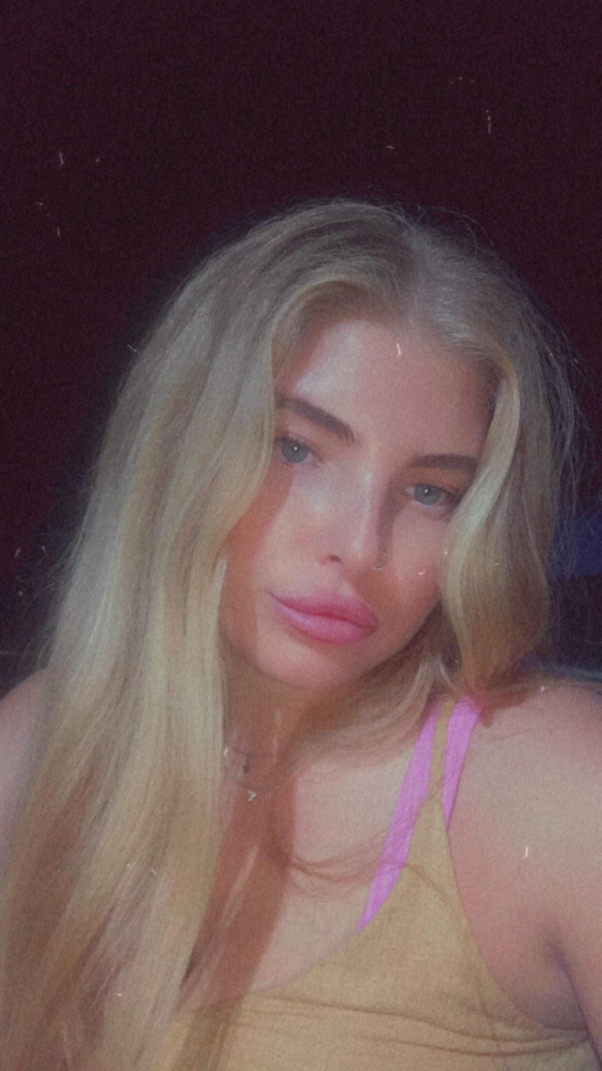 Lips for days | Scrolller