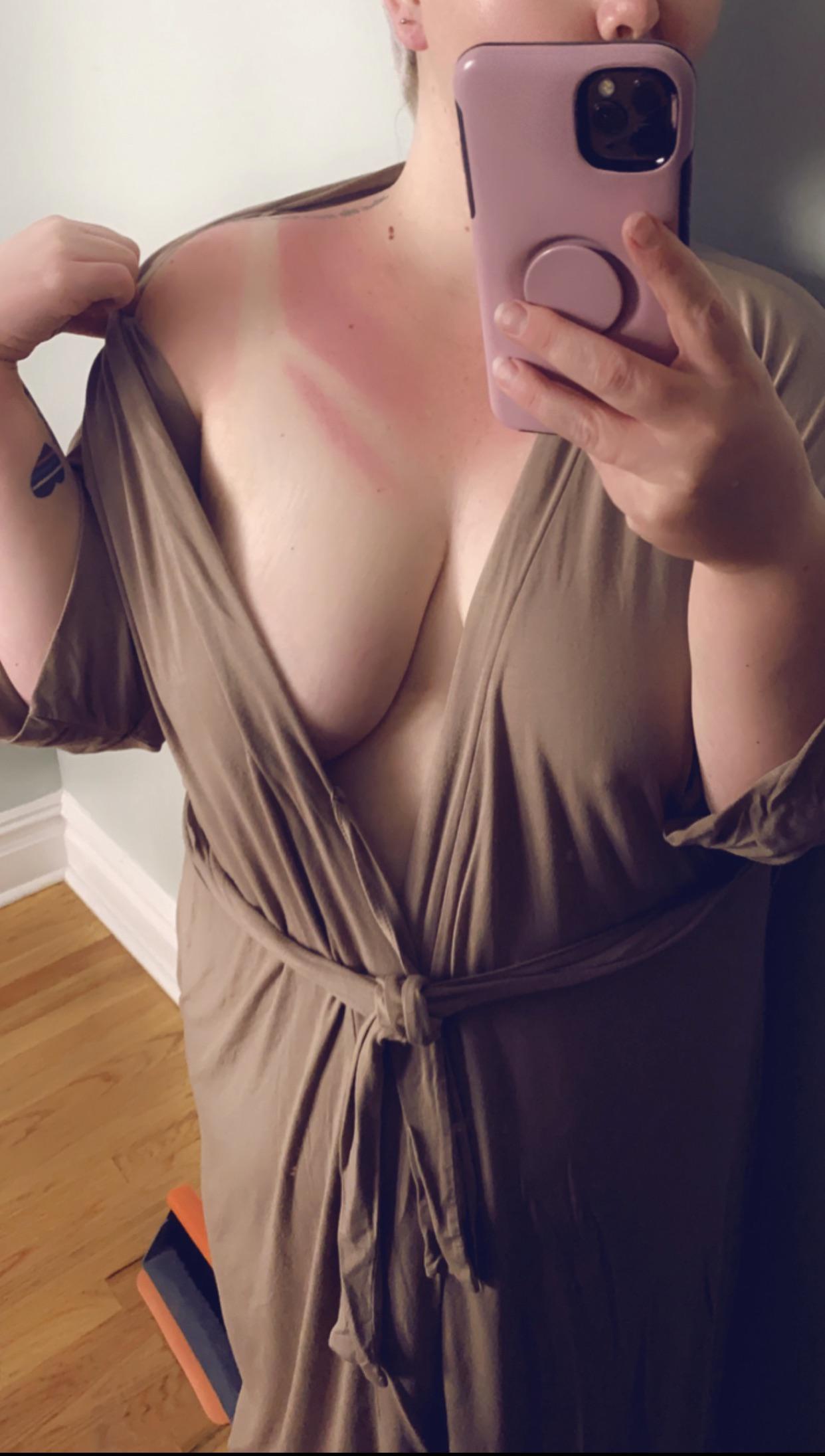 Little too much sun | Scrolller