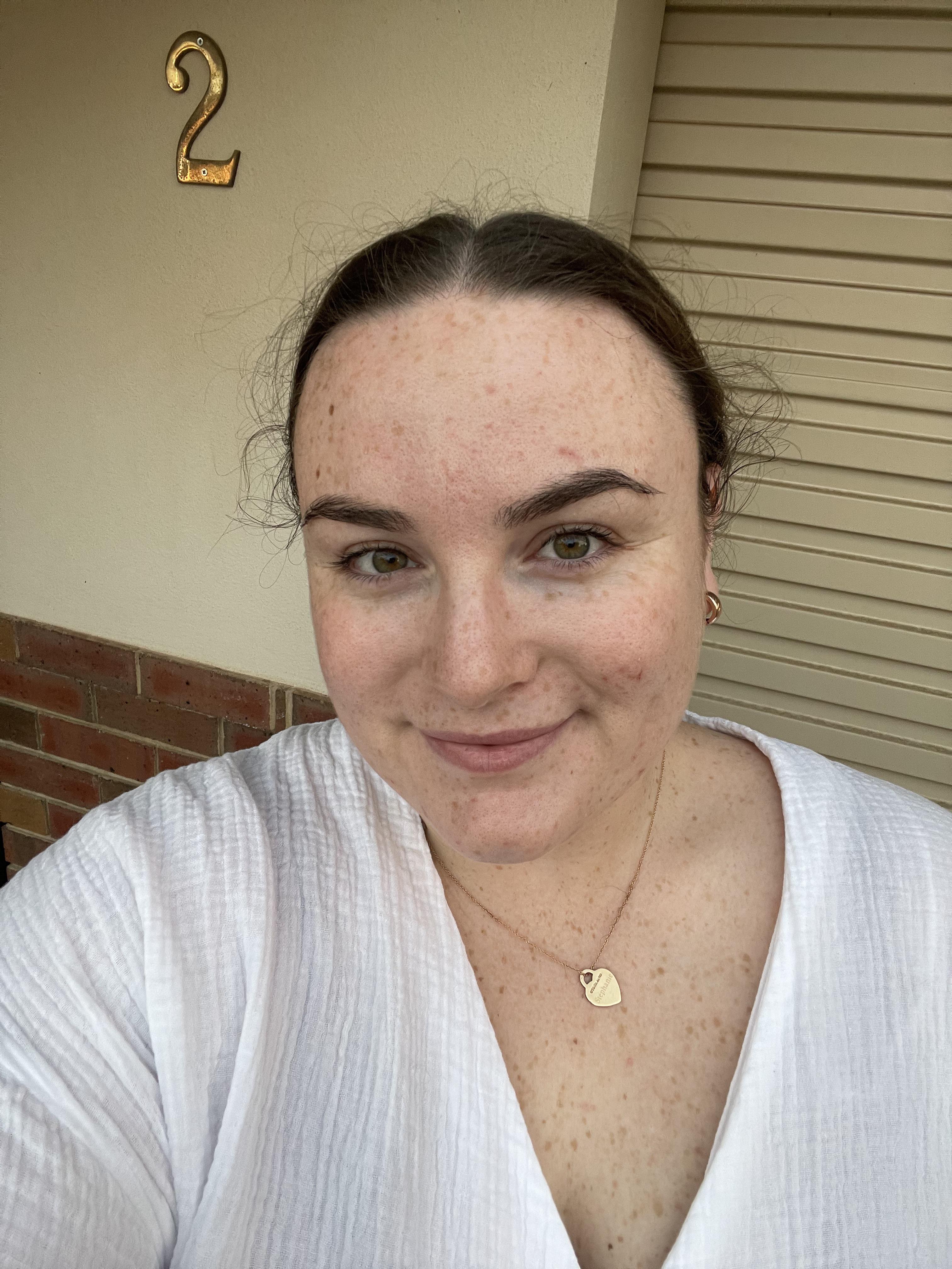 looking forward to summer when my freckles get darker! | Scrolller