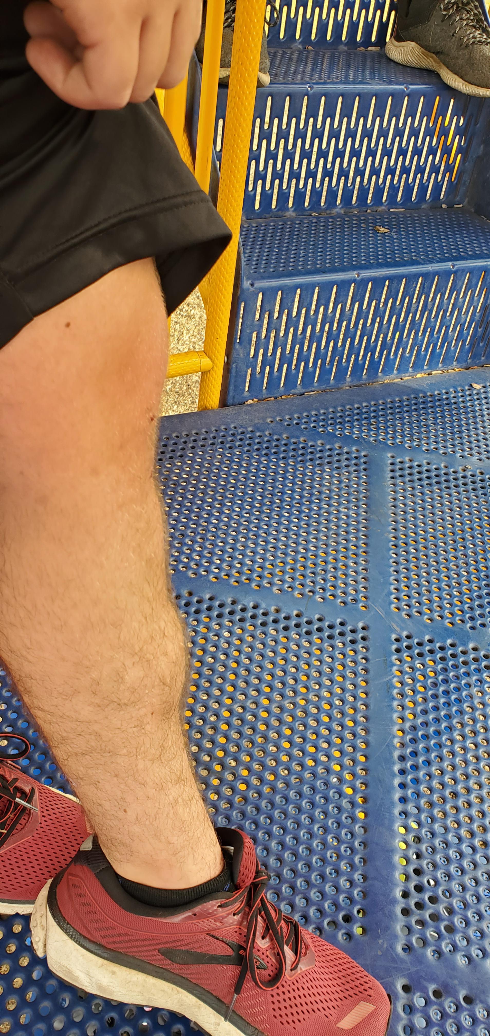 Man with 2nd knee | Scrolller