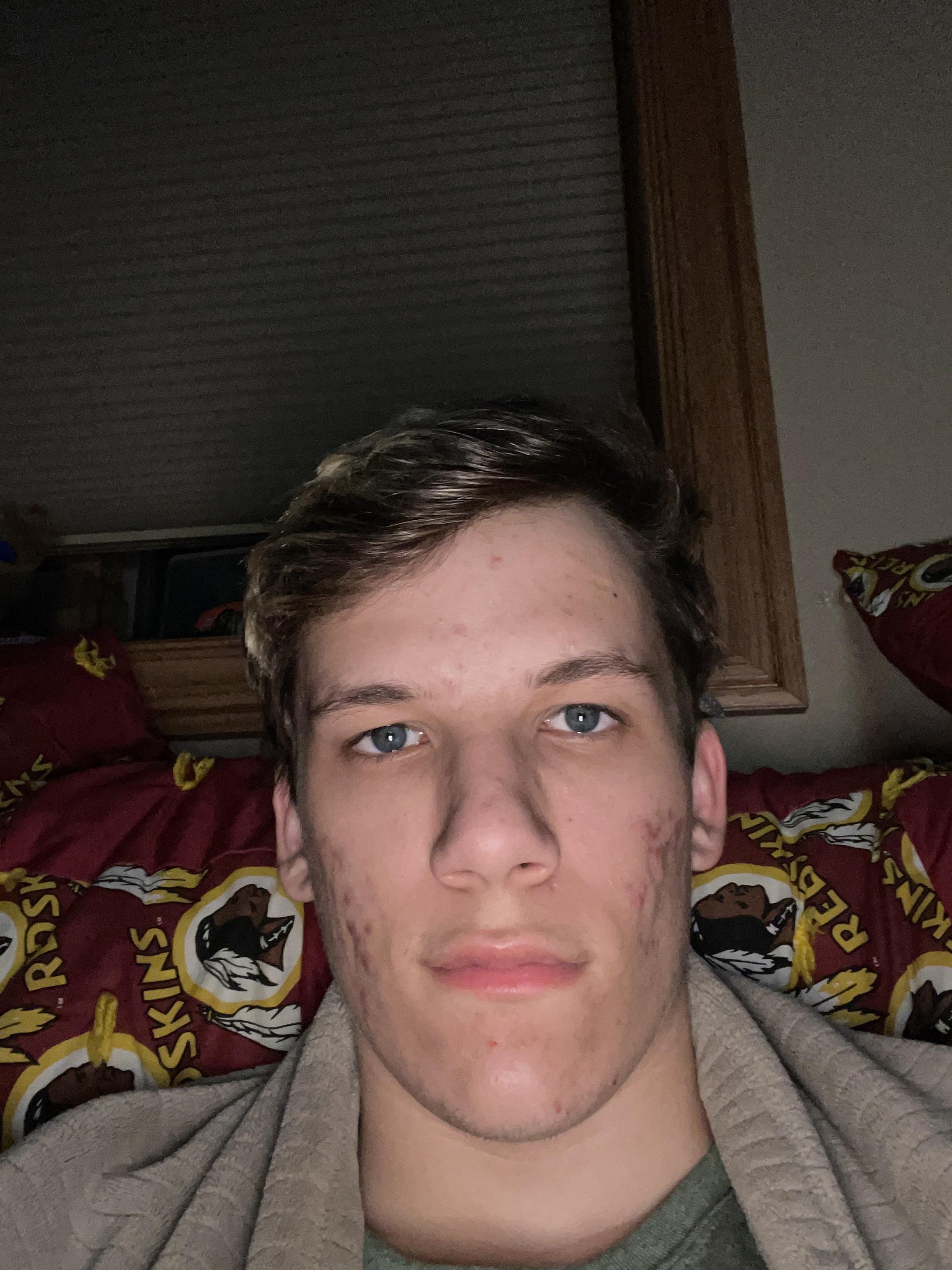 Me (I’m back)- Old account got deleted | Scrolller