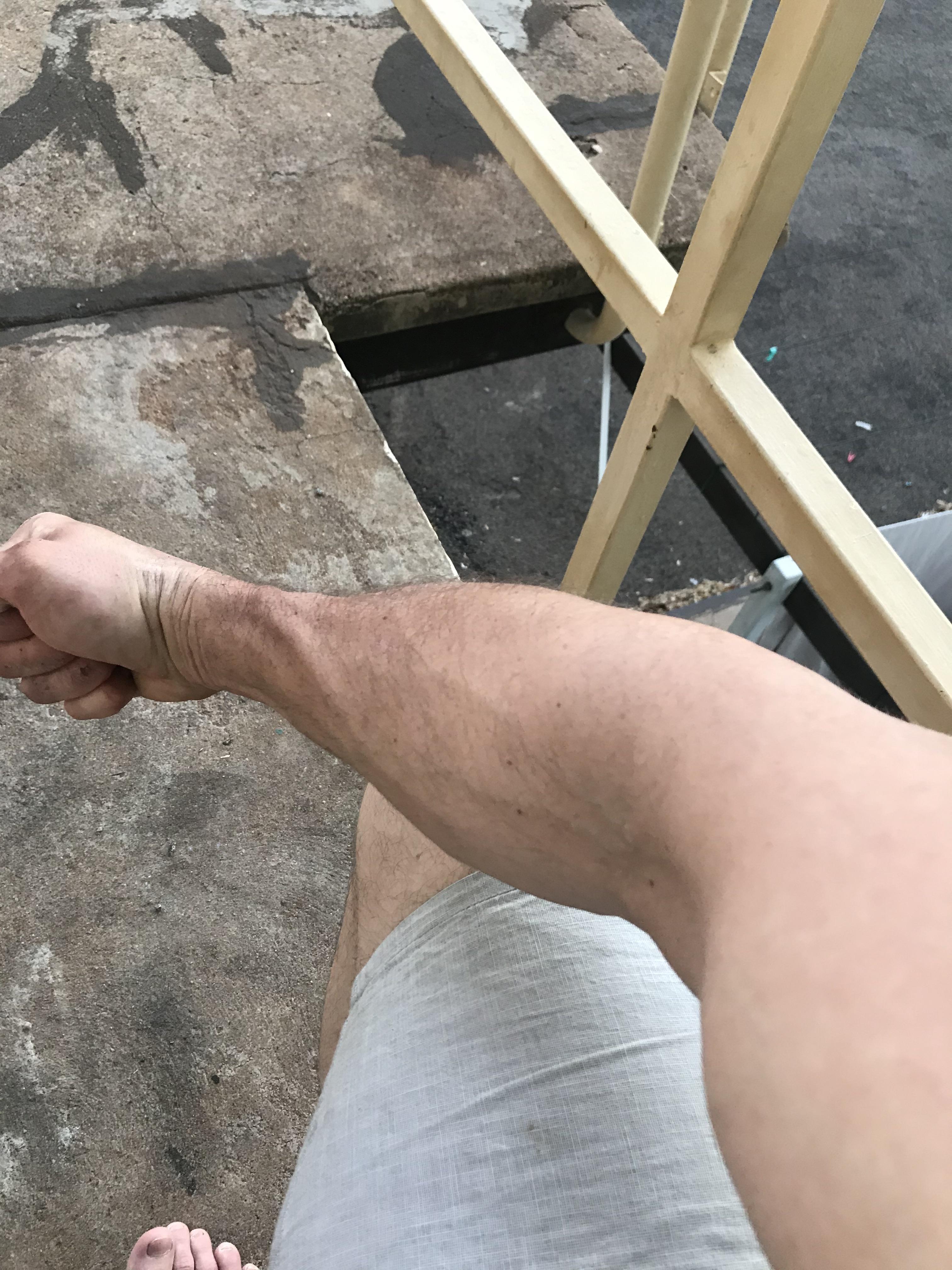 Mechanics forearm | Scrolller
