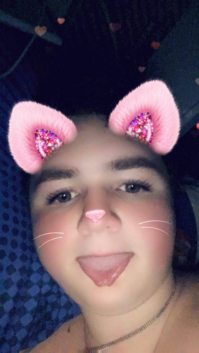 missing part of my tongue | Scrolller