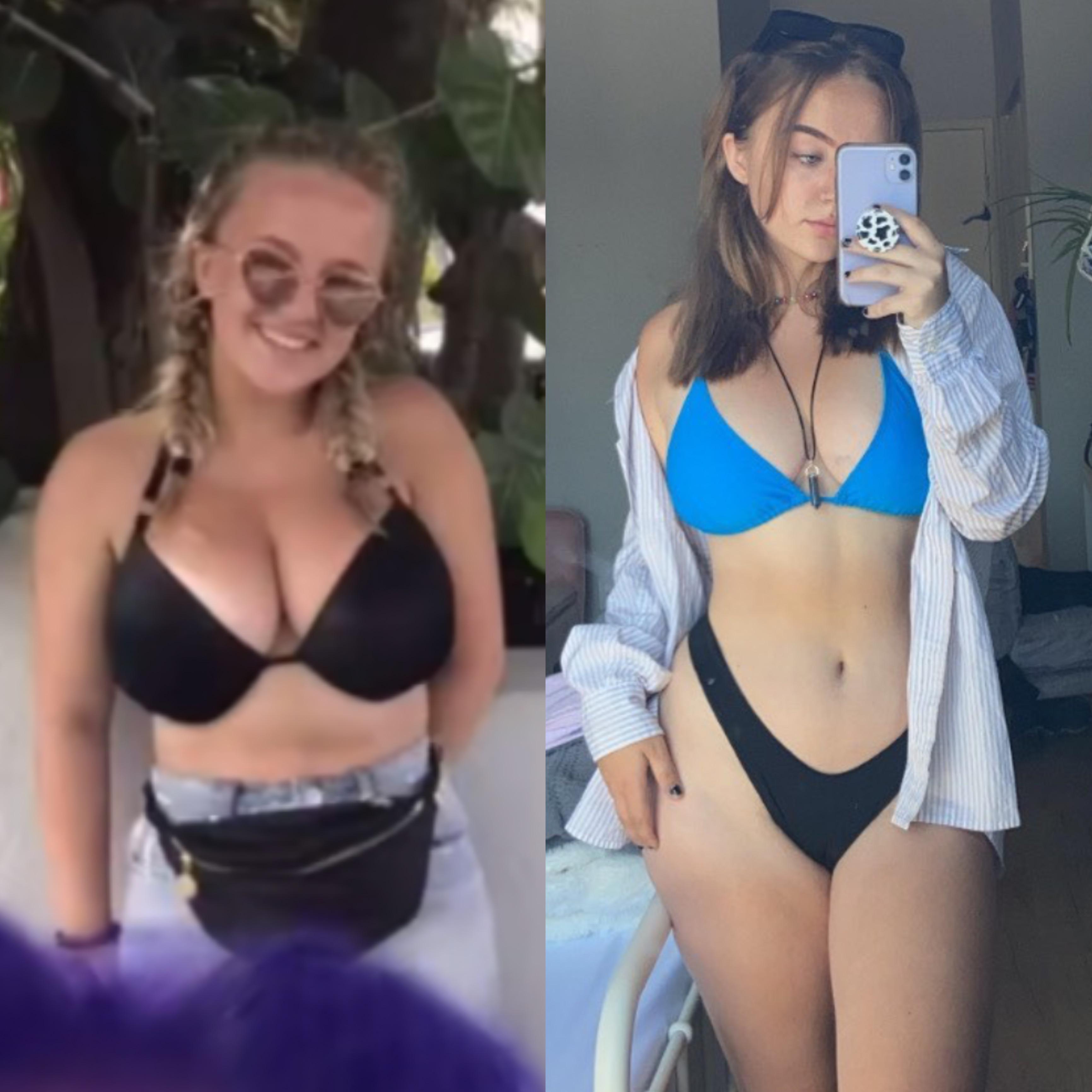 Mollyrrusso on tiktok before and after her breast reduction | Scrolller