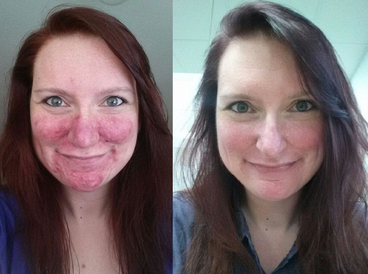 My before and after | Scrolller