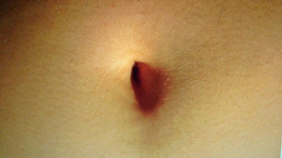 my belly button | Scrolller