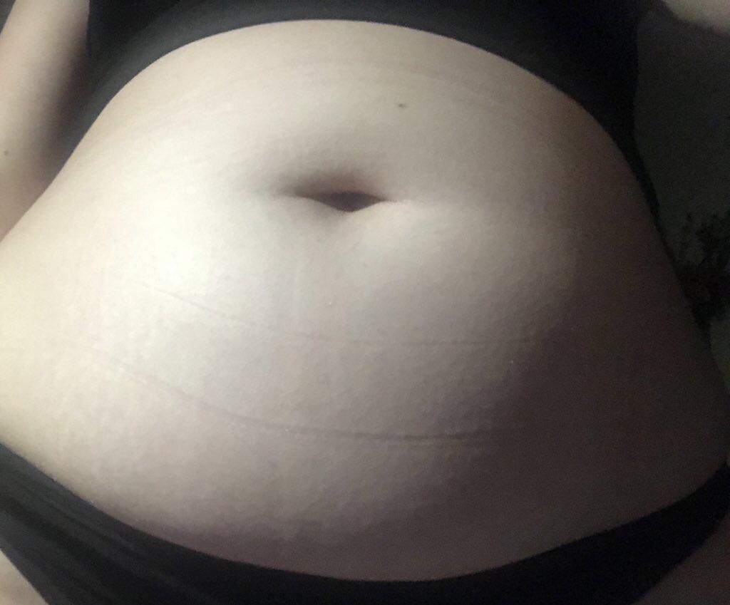 My belly is sooo swollen and tight 😫😫😫 | Scrolller
