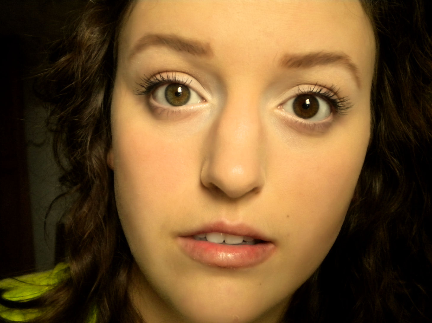 My eye colors are the result of nerve damage as an infant | Scrolller