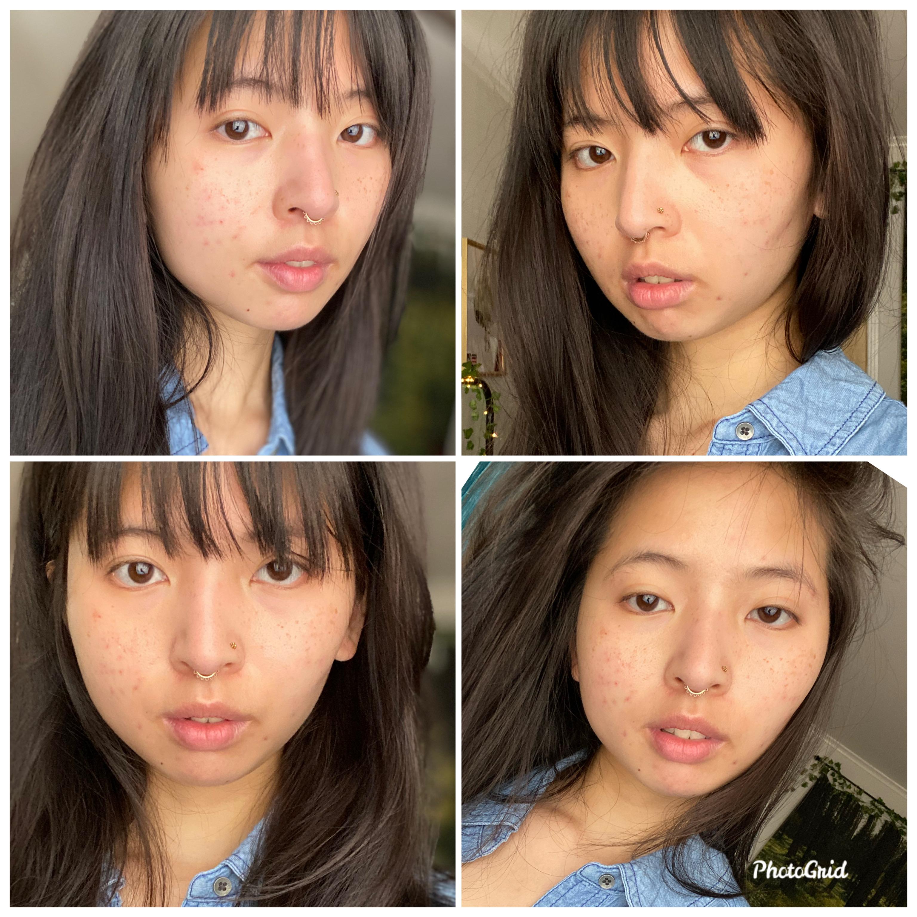 My face is extremely asymmetrical, and I’m not sure where to start. Details in comments | Scrolller