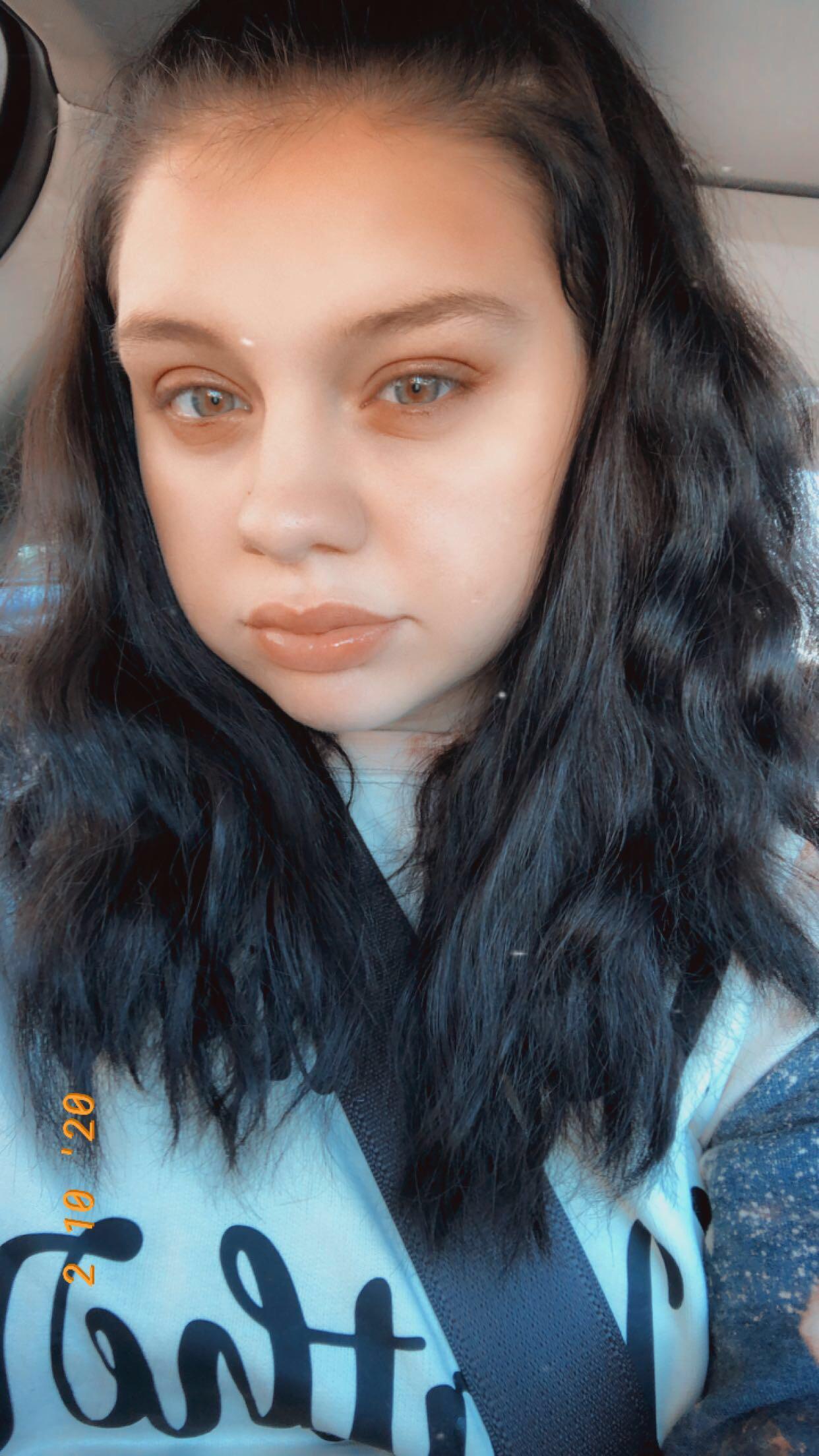 My face looks swollen | Scrolller